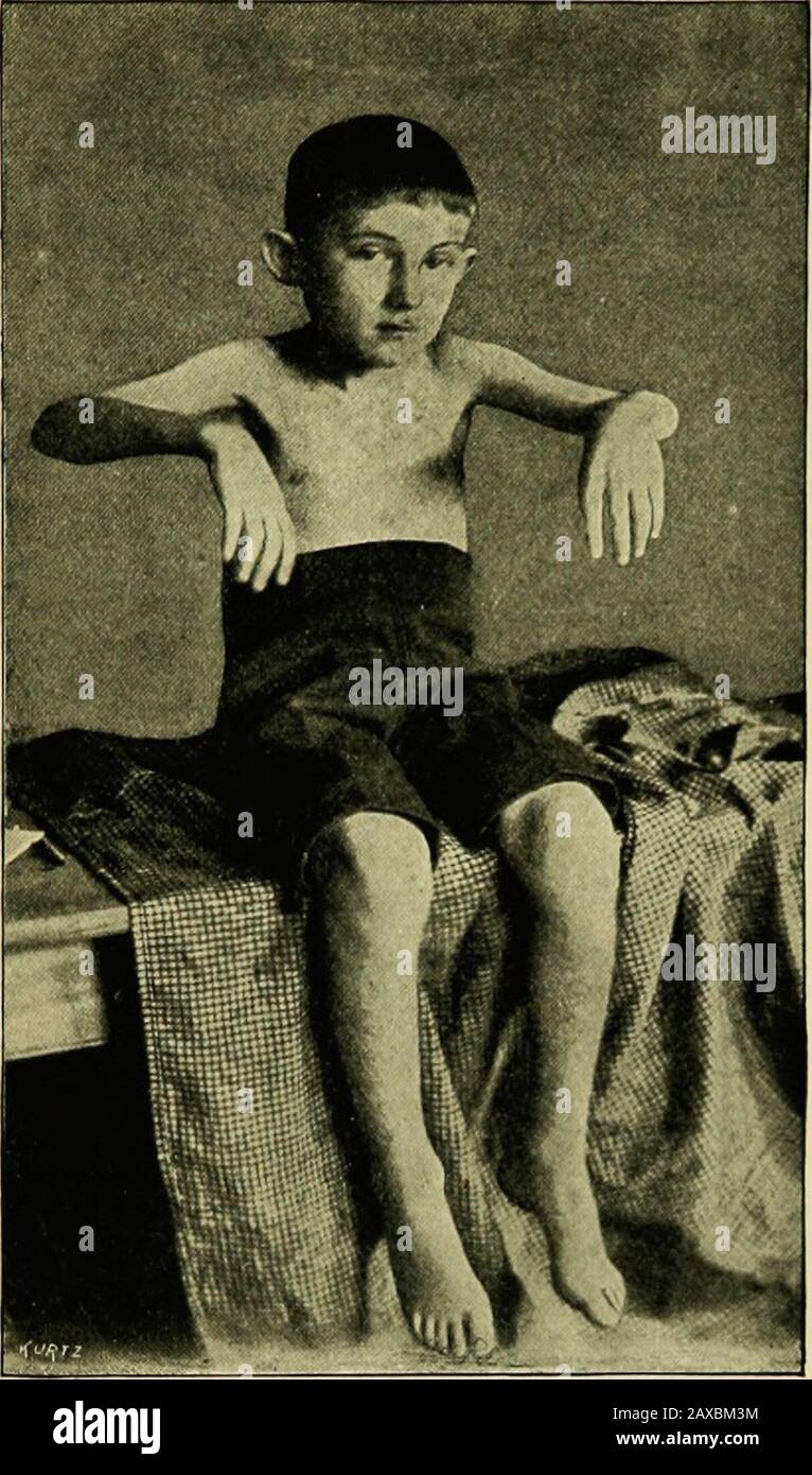 Brachial plexus arm hi-res stock photography and images - Alamy