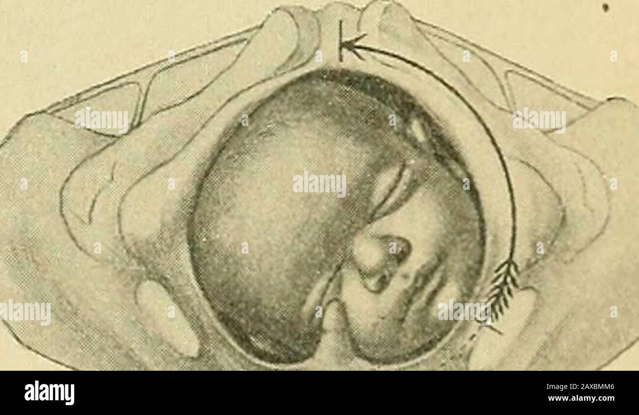 The practice of obstetrics, designed for the use of students and ...