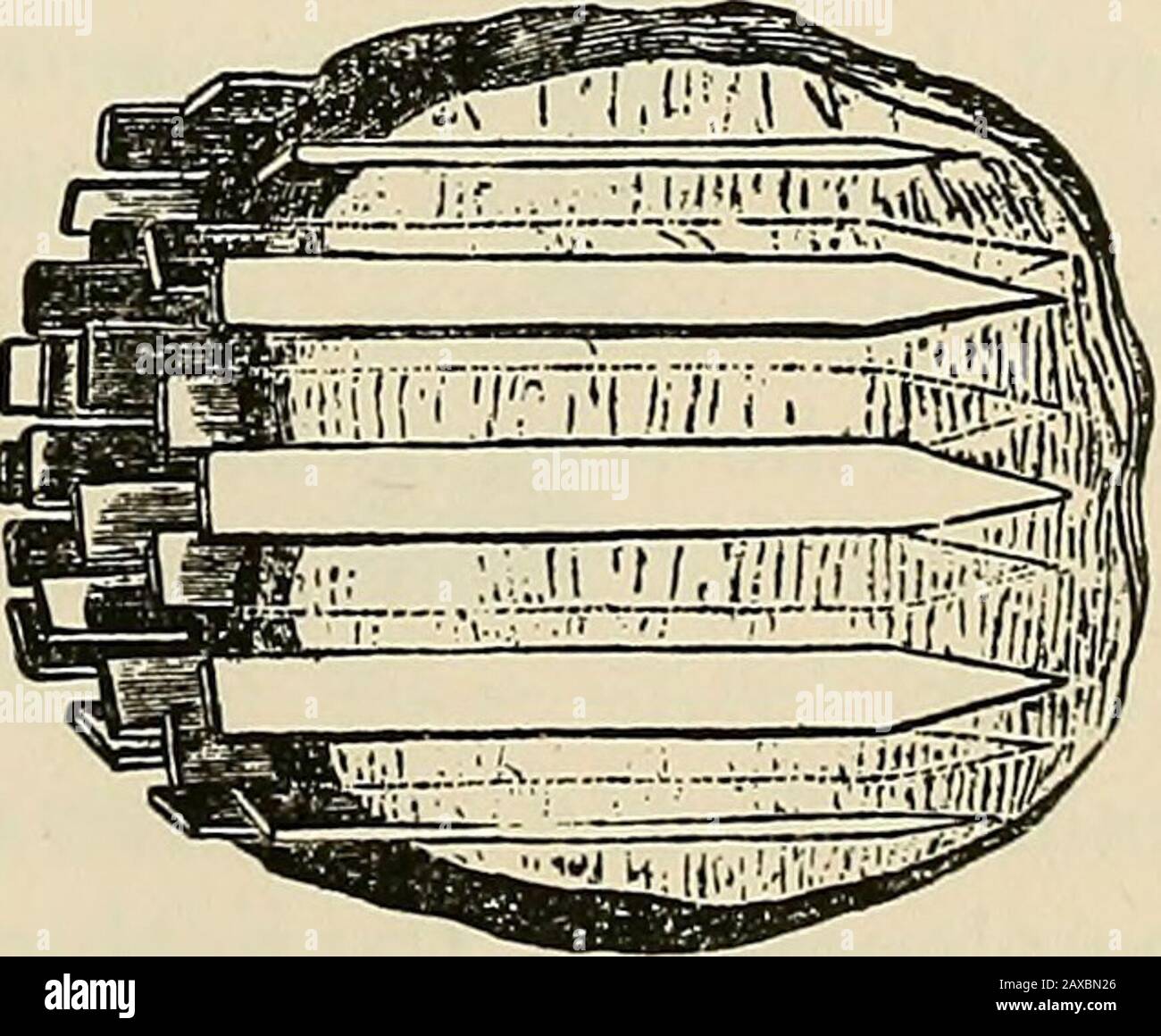 The pathology and surgical treatment of tumors . Fig. 47.—Cauterisation ...