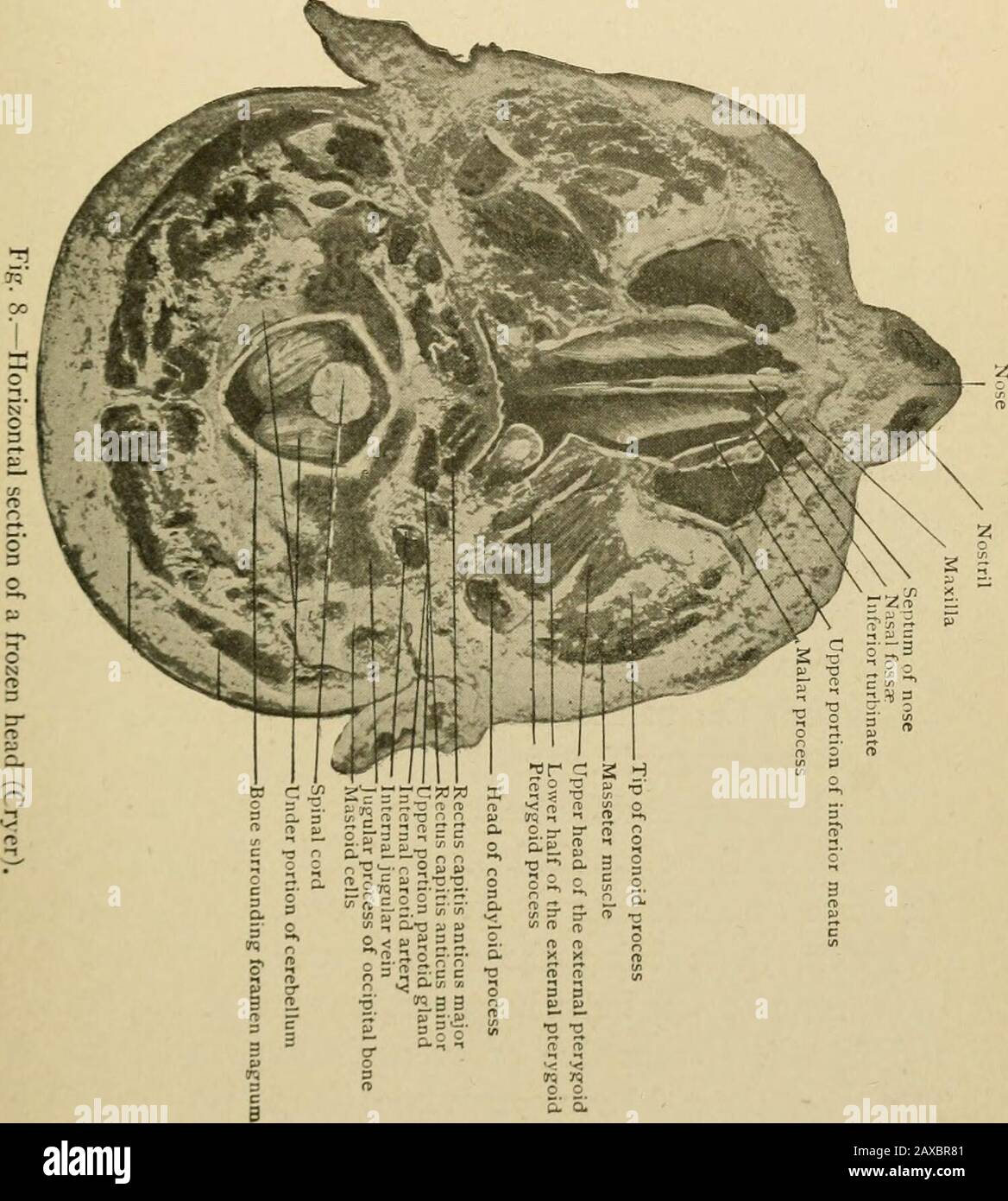 Applied anatomy and oral surgery for dental students . e, is the ...