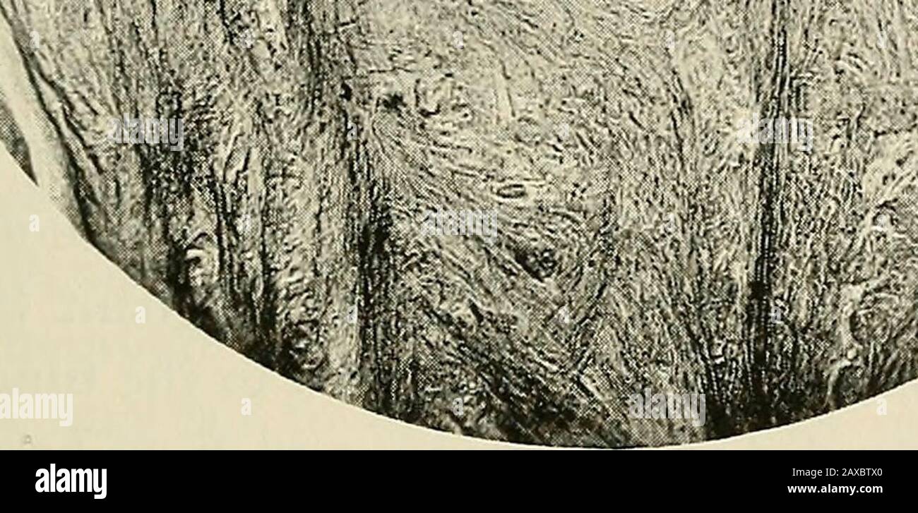 Operation paget hi-res stock photography and images - Alamy