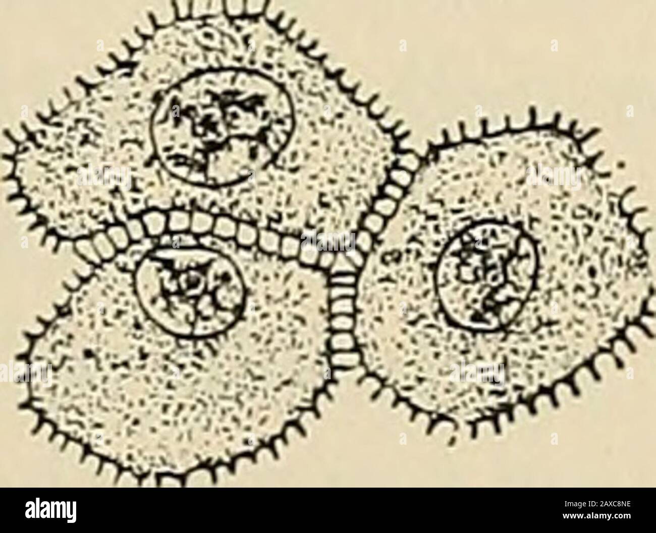 The pathology and surgical treatment of tumors . Fig. 4.—Prickle-cells ...
