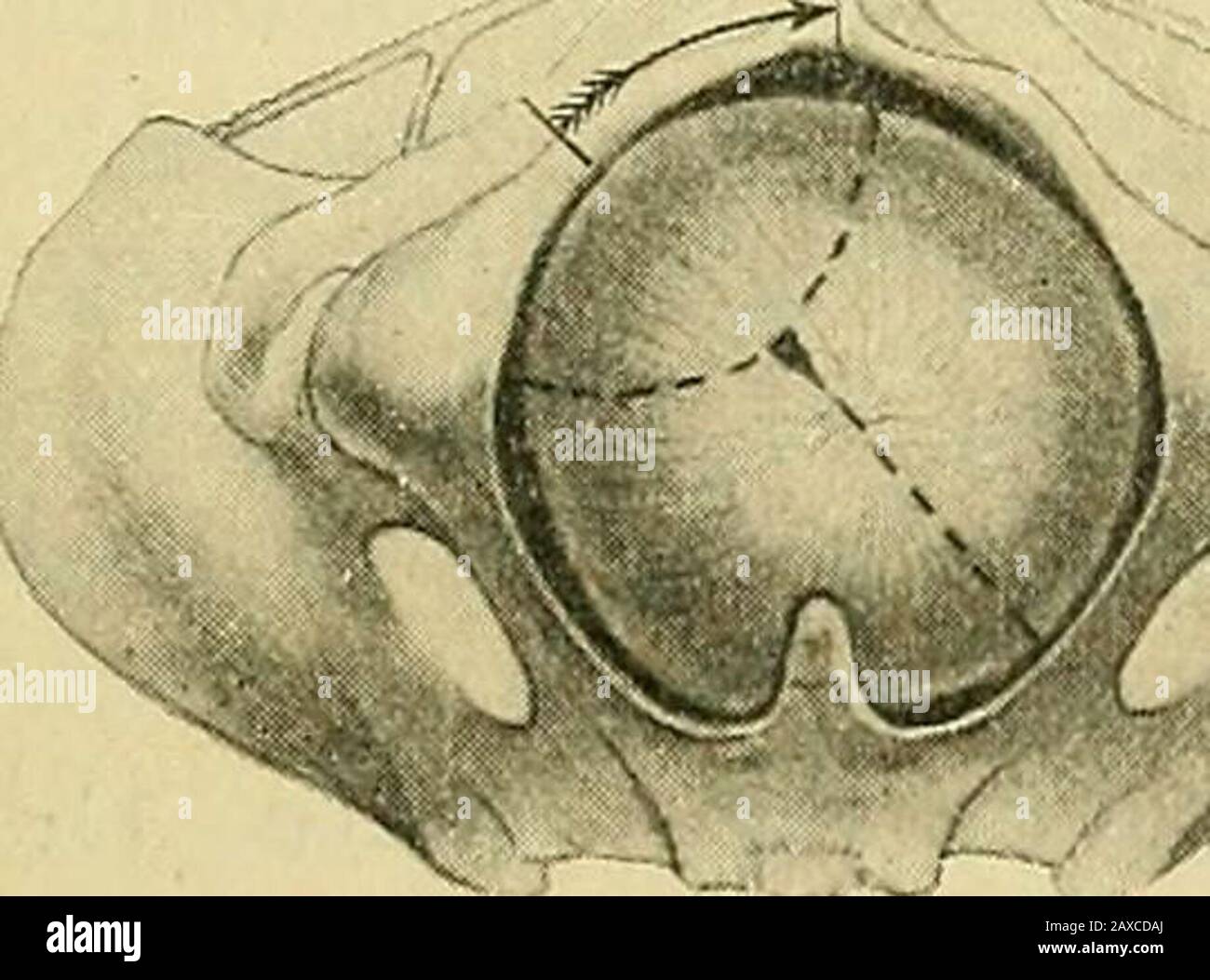 Occiput anterior hi-res stock photography and images - Alamy