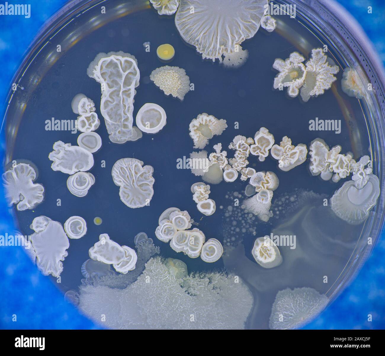 Tests for skin fungal diseases. Samples of fungus causing skin diseases ...