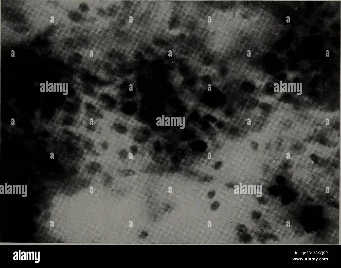 Bone marrow mononuclear cells hi-res stock photography and images - Alamy