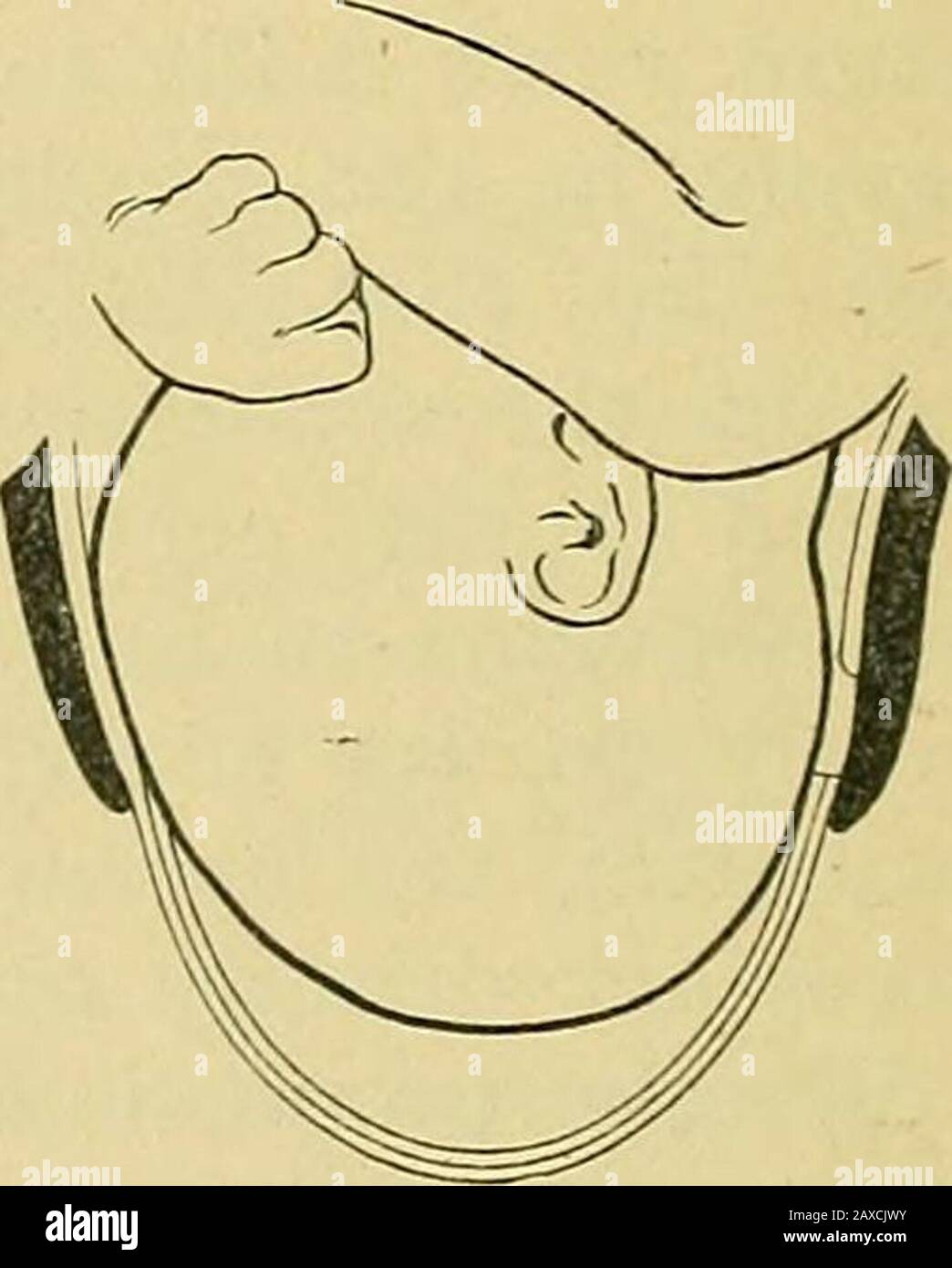 Uterine rupture hi-res stock photography and images - Alamy