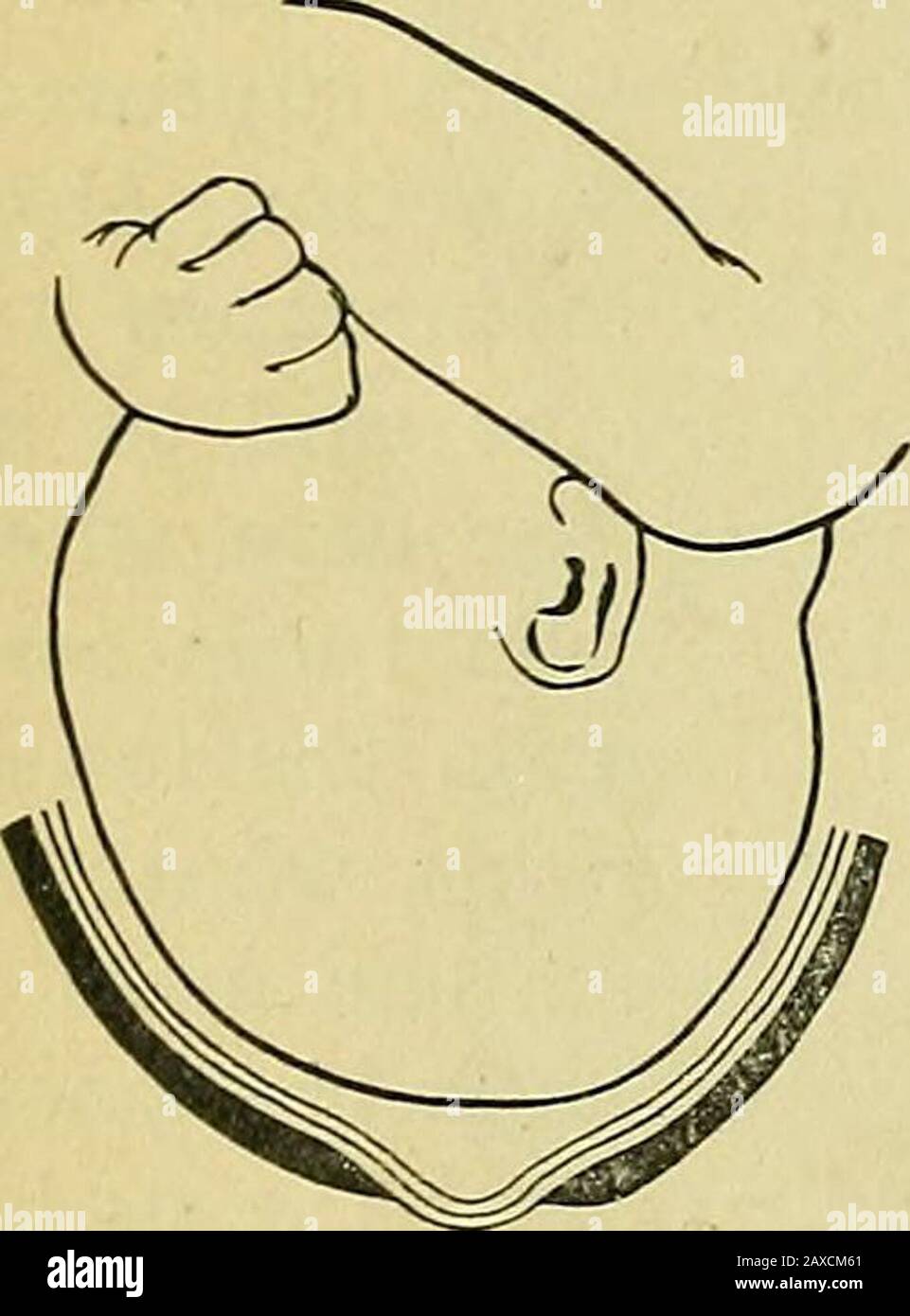 Cervix labor hi-res stock photography and images - Alamy