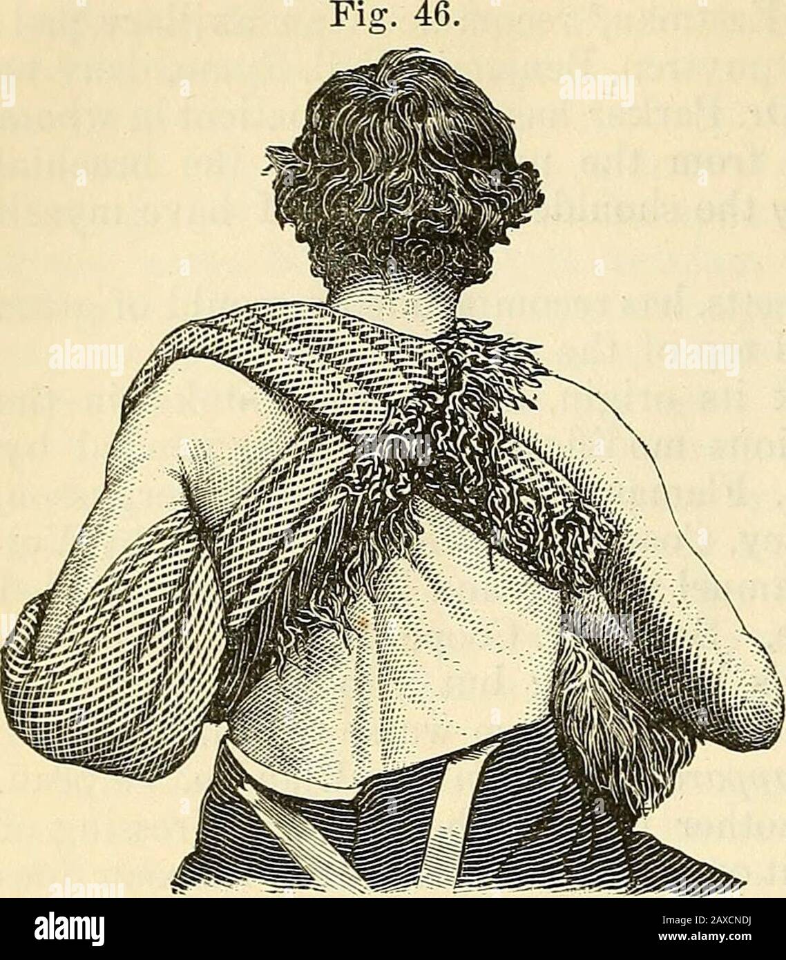 Sternal fractures hi-res stock photography and images - Alamy