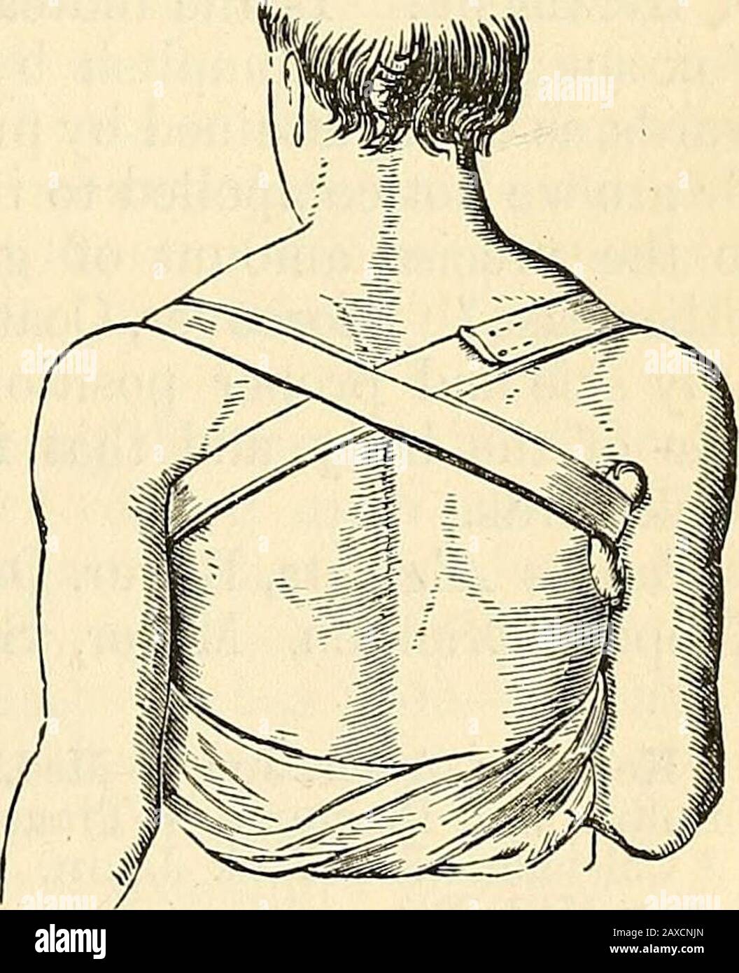 A practical treatise on fractures and dislocations . ouldbe placed at ...