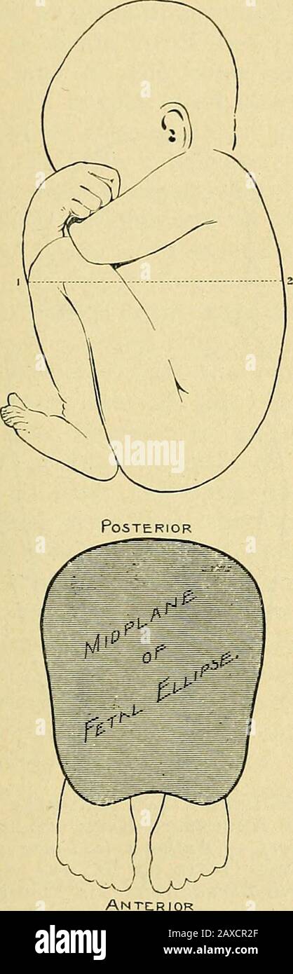 547 4 cm hi-res stock photography and images - Alamy