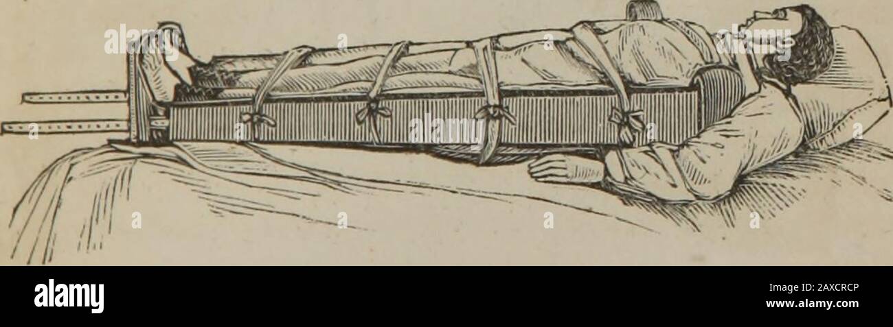 Minor surgery, or, Hints on the every-day duties of the surgeon . ide ...