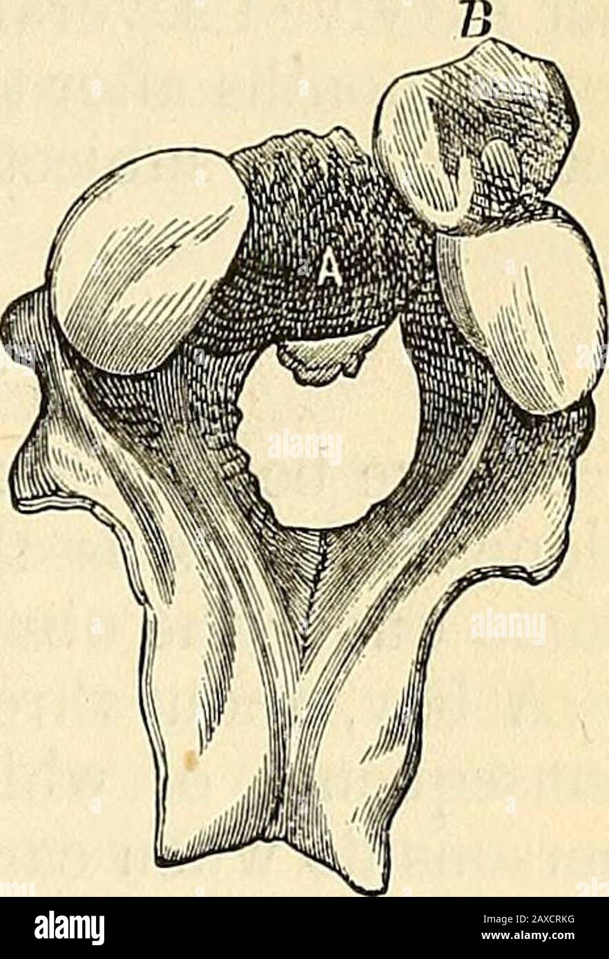 Odontoid process hi-res stock photography and images - Alamy
