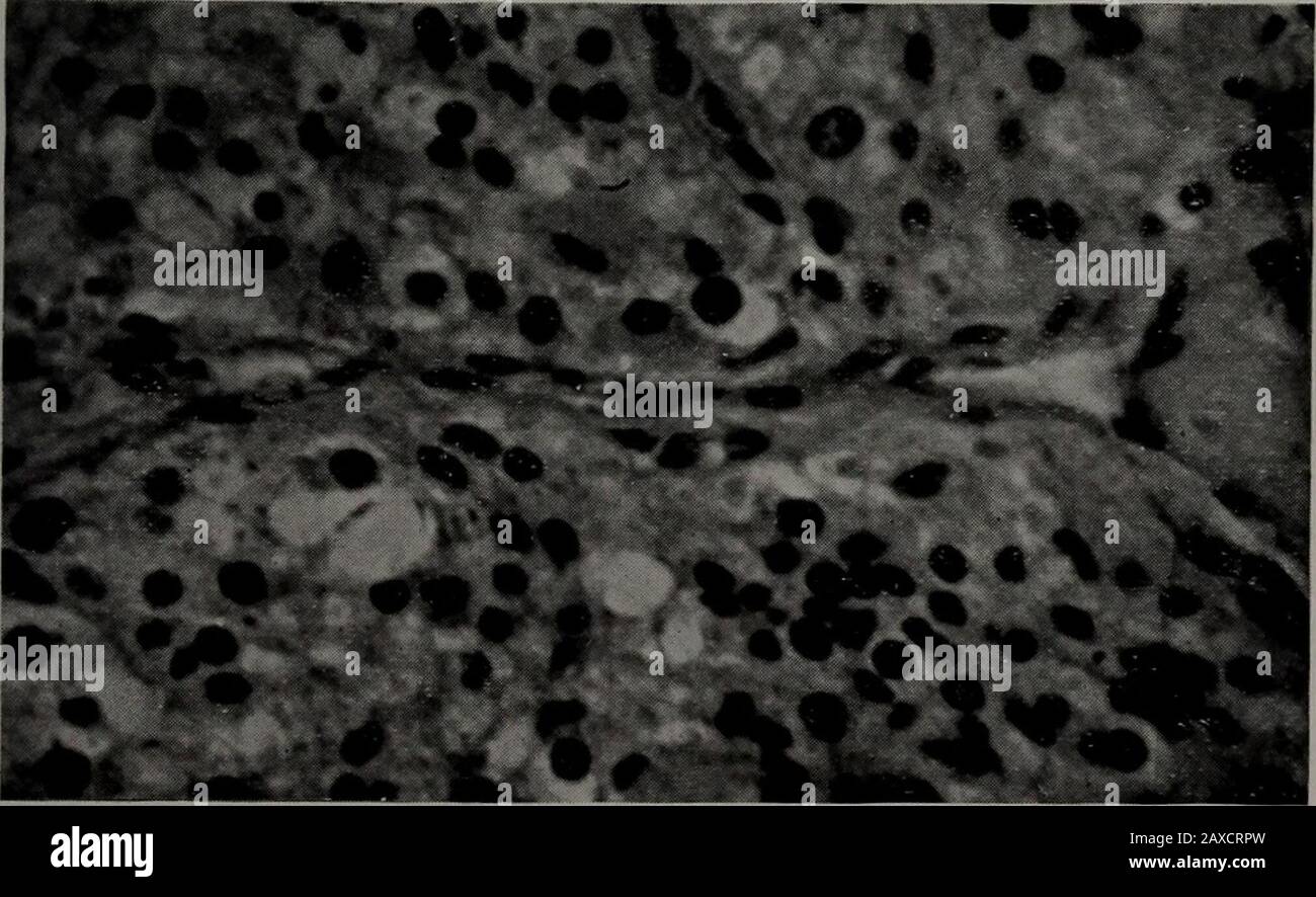 Relative size cells hi-res stock photography and images - Alamy