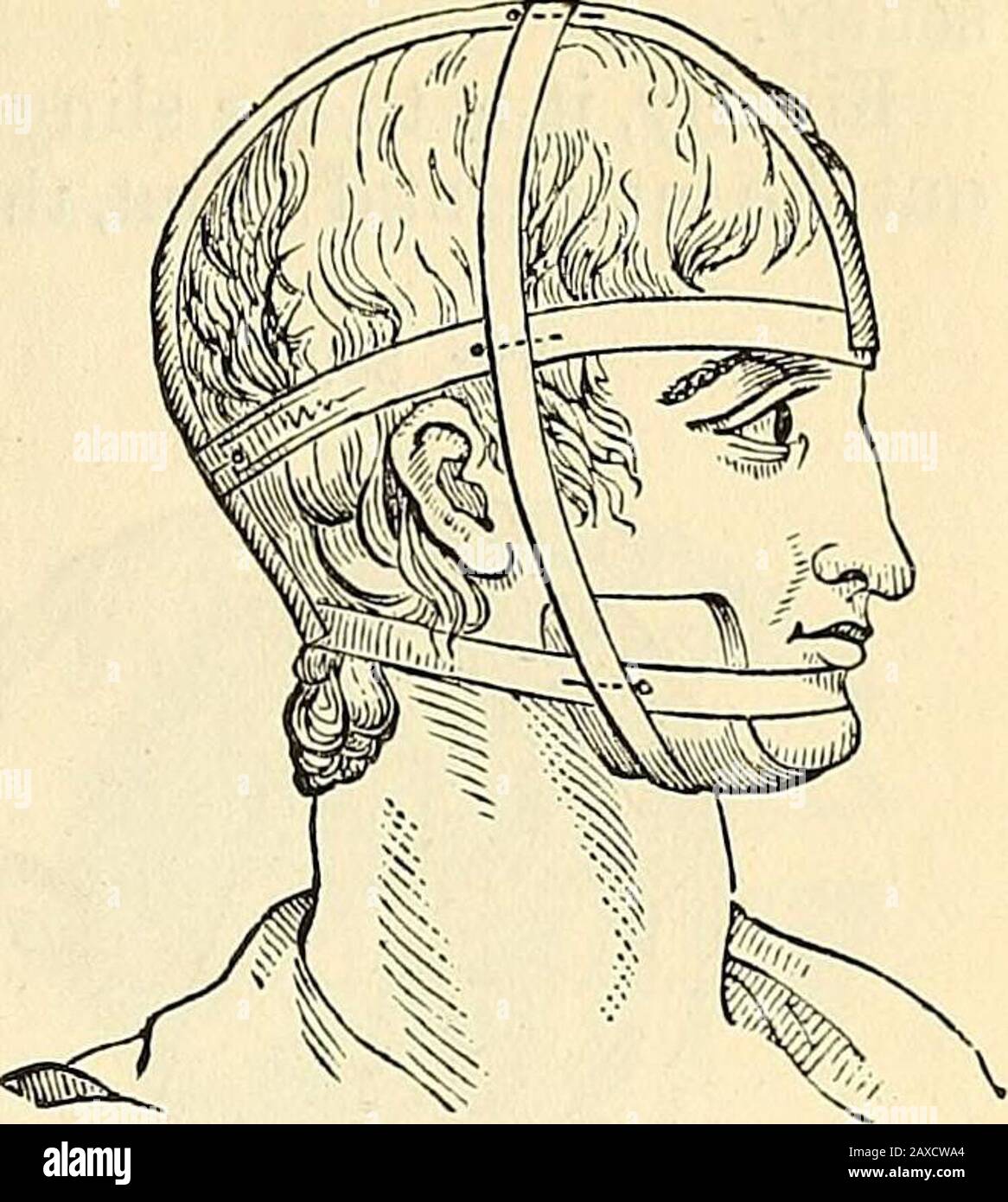 A practical treatise on fractures and dislocations . en the apparatus ...