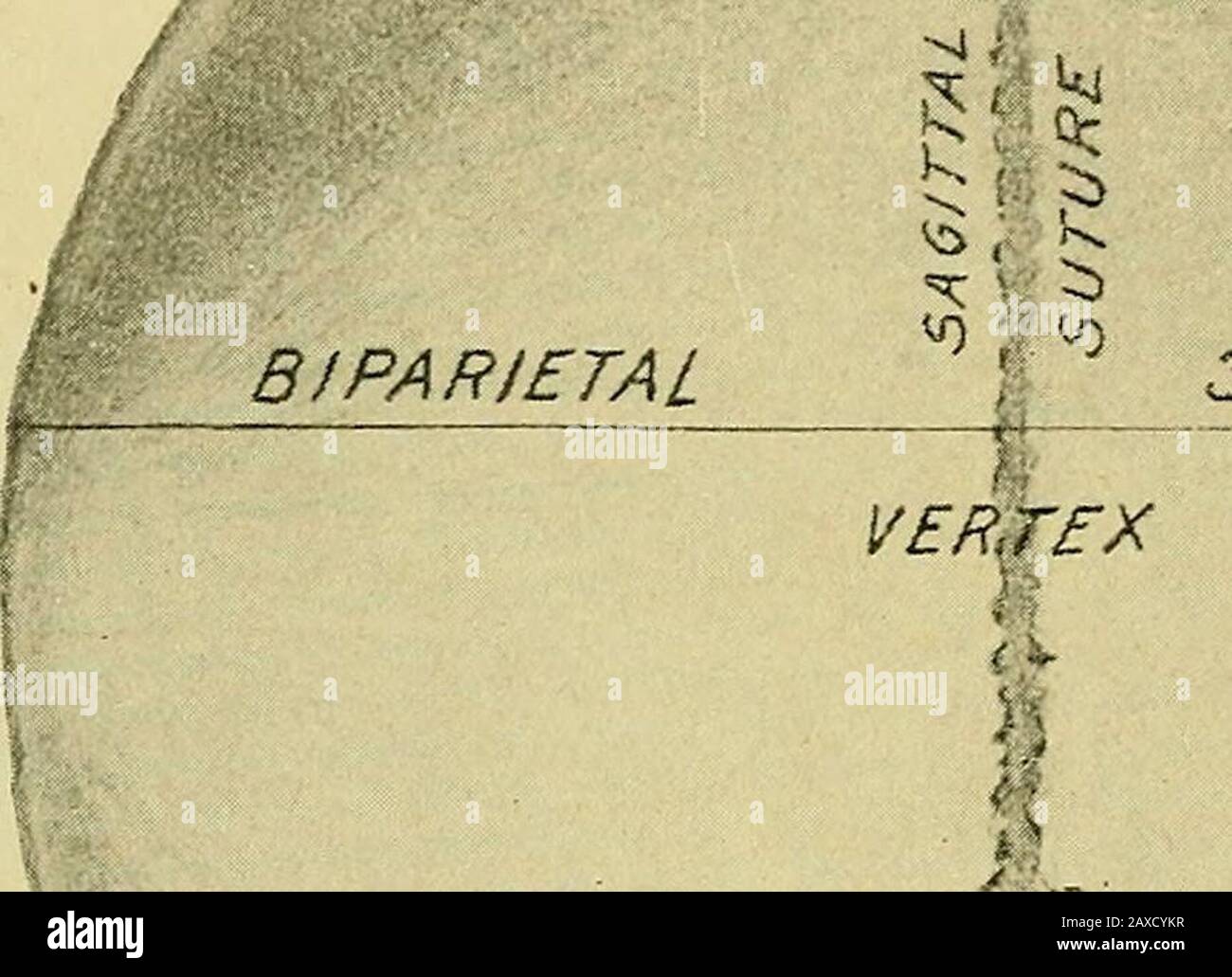 Posterolateral Fontanelle