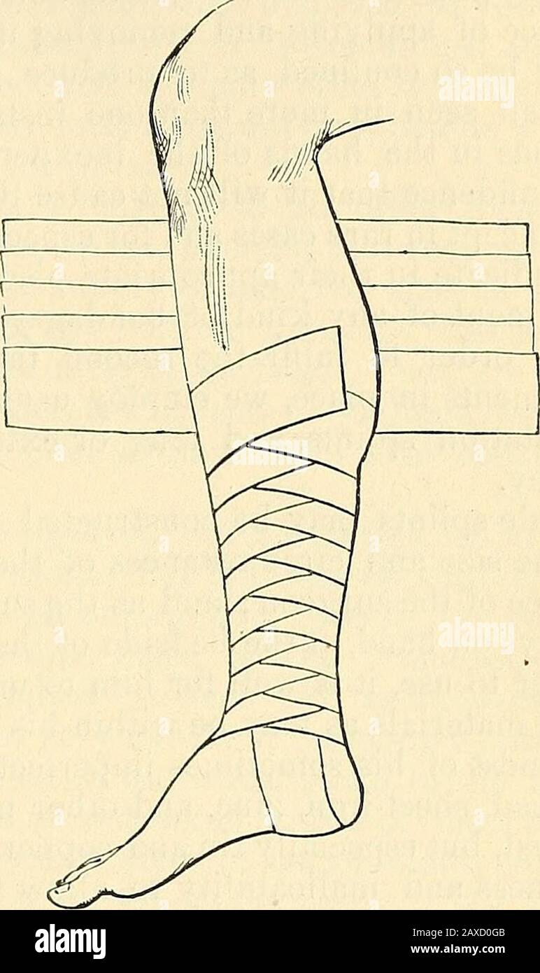 Retained object hi-res stock photography and images - Alamy