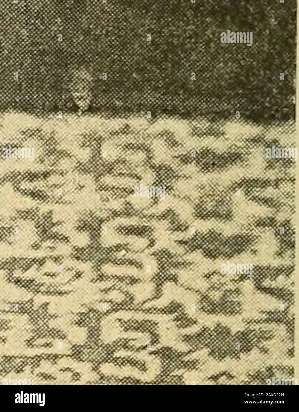 Osteoclasis hi-res stock photography and images - Alamy