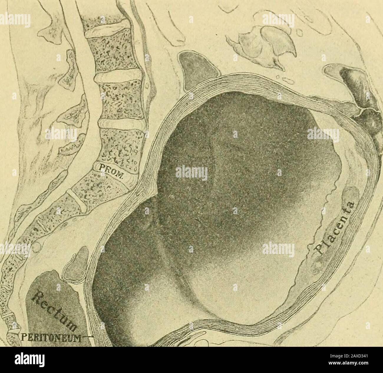 Cervical canal of uterus hi-res stock photography and images - Alamy