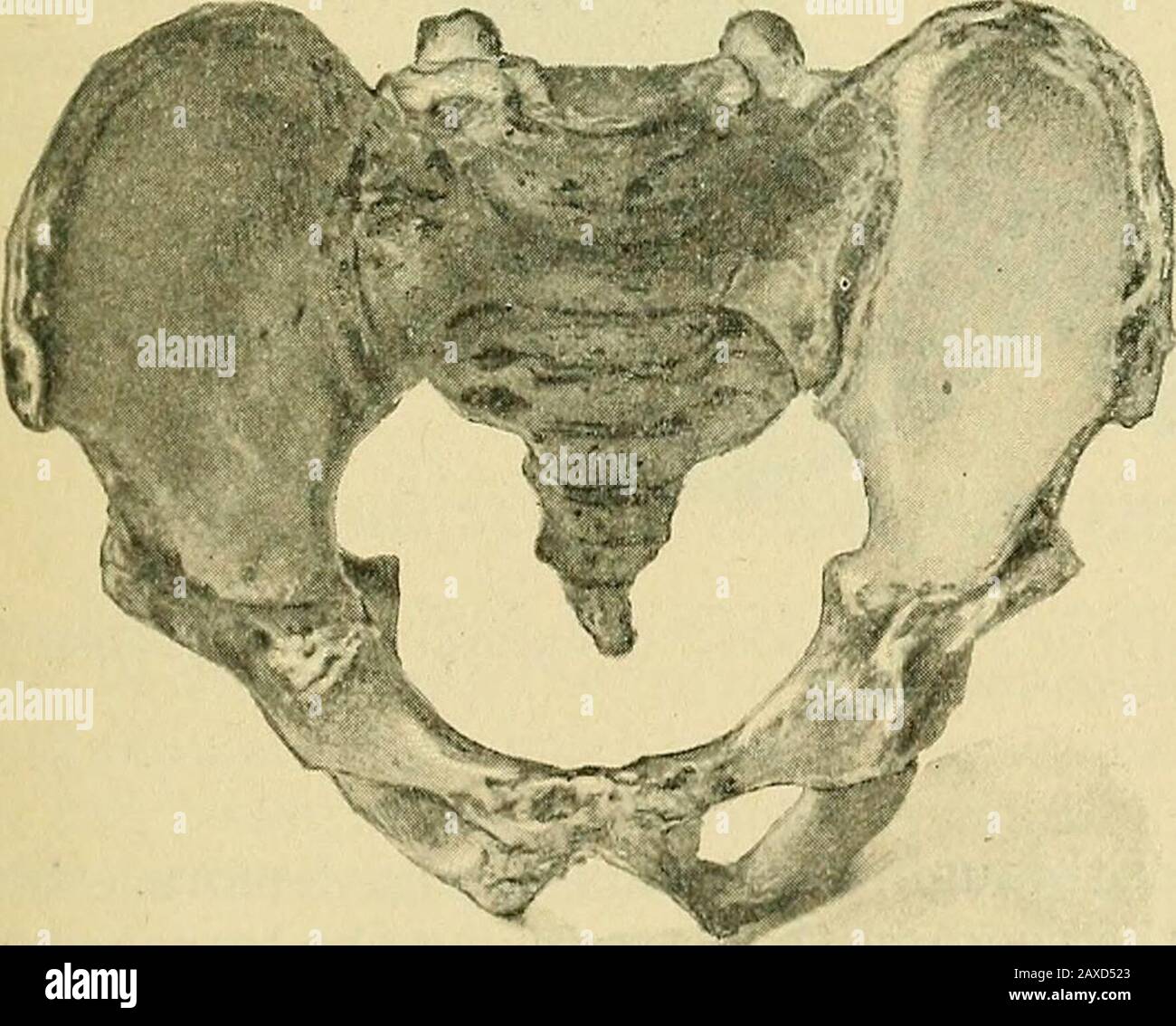 The practice of obstetrics, designed for the use of students and ...