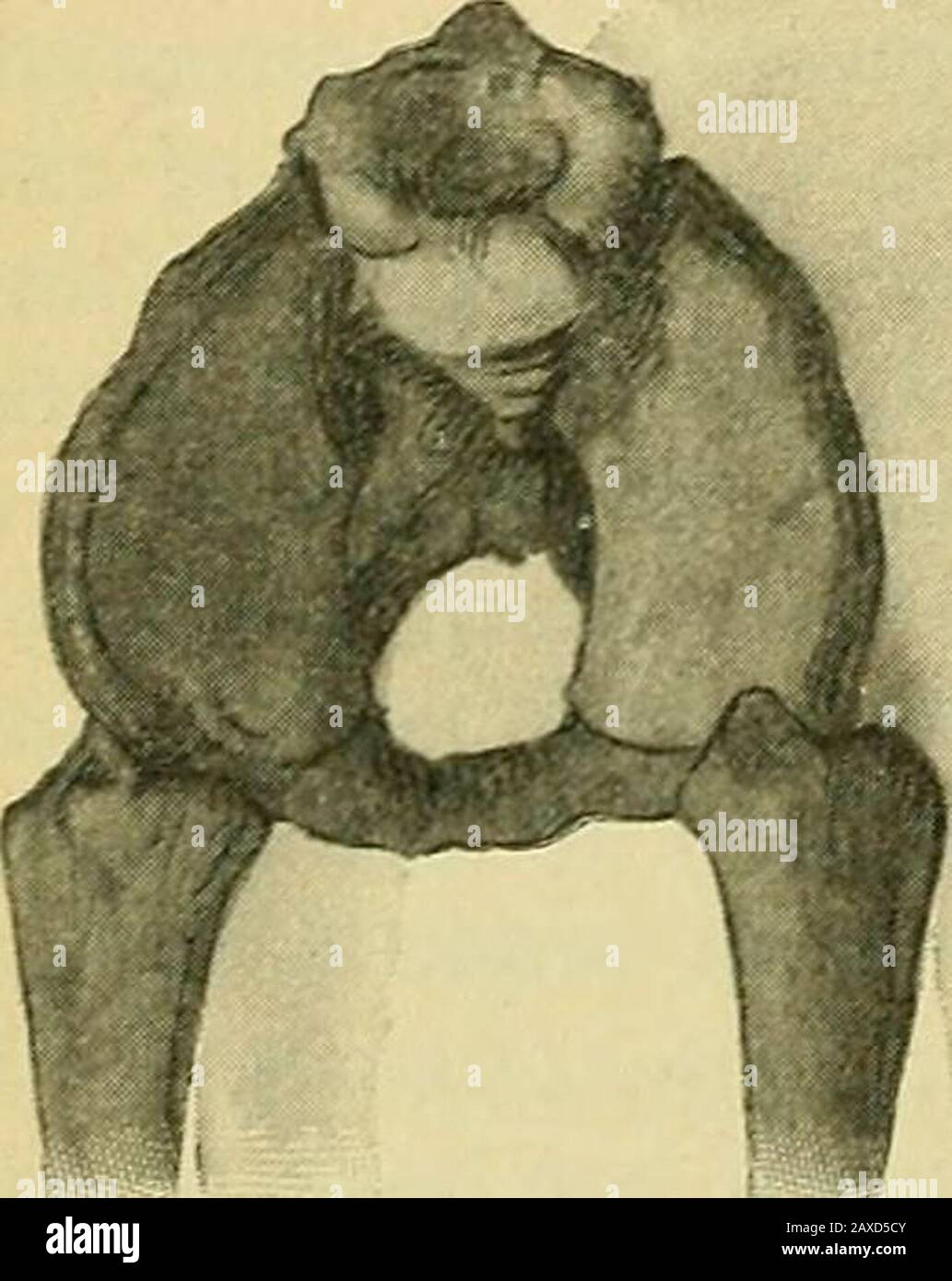 Lithotomy position hi-res stock photography and images - Alamy