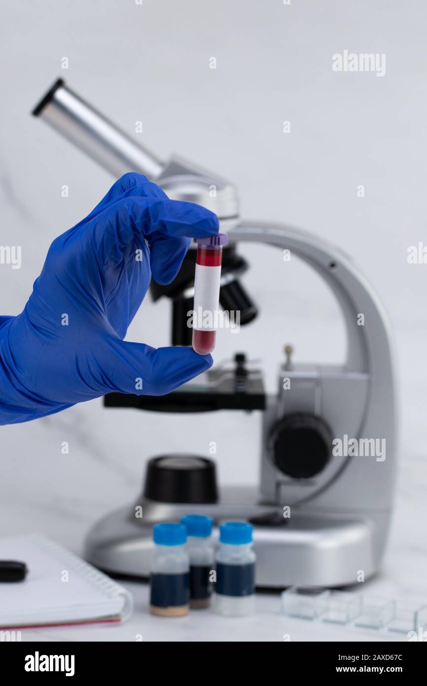 Nurse holding test tube with blood, close-up. Blood test concept Stock ...