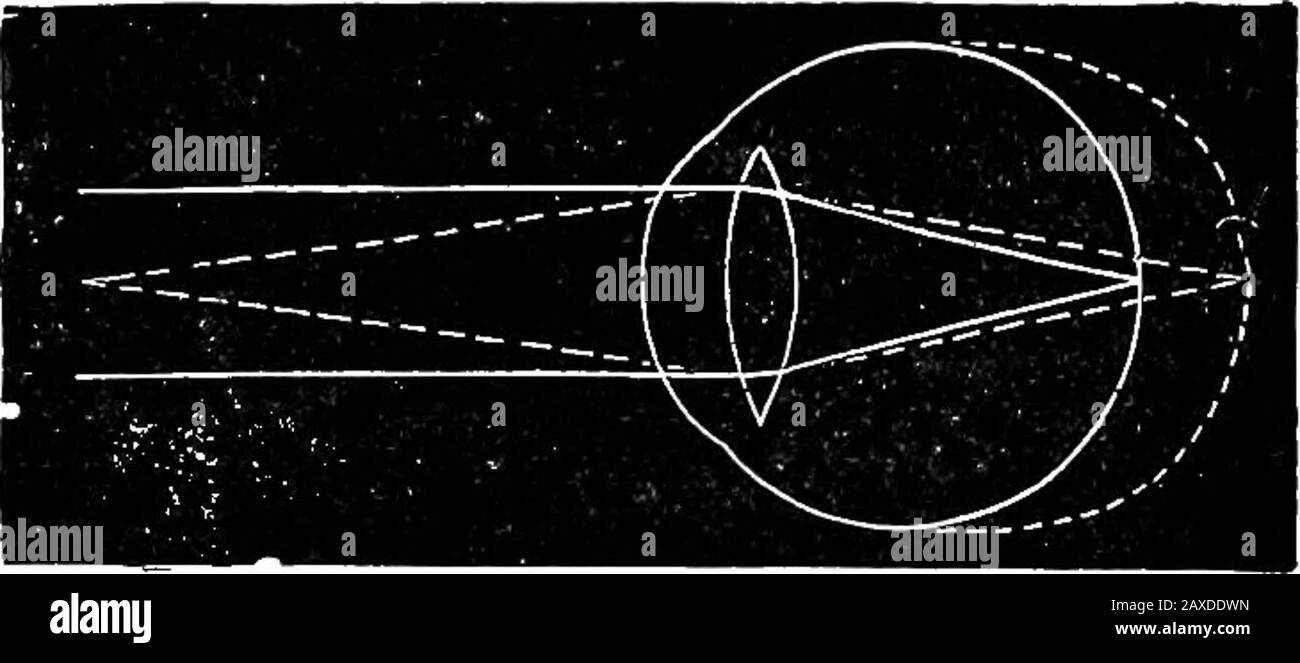 Diverging lenses hi-res stock photography and images - Alamy