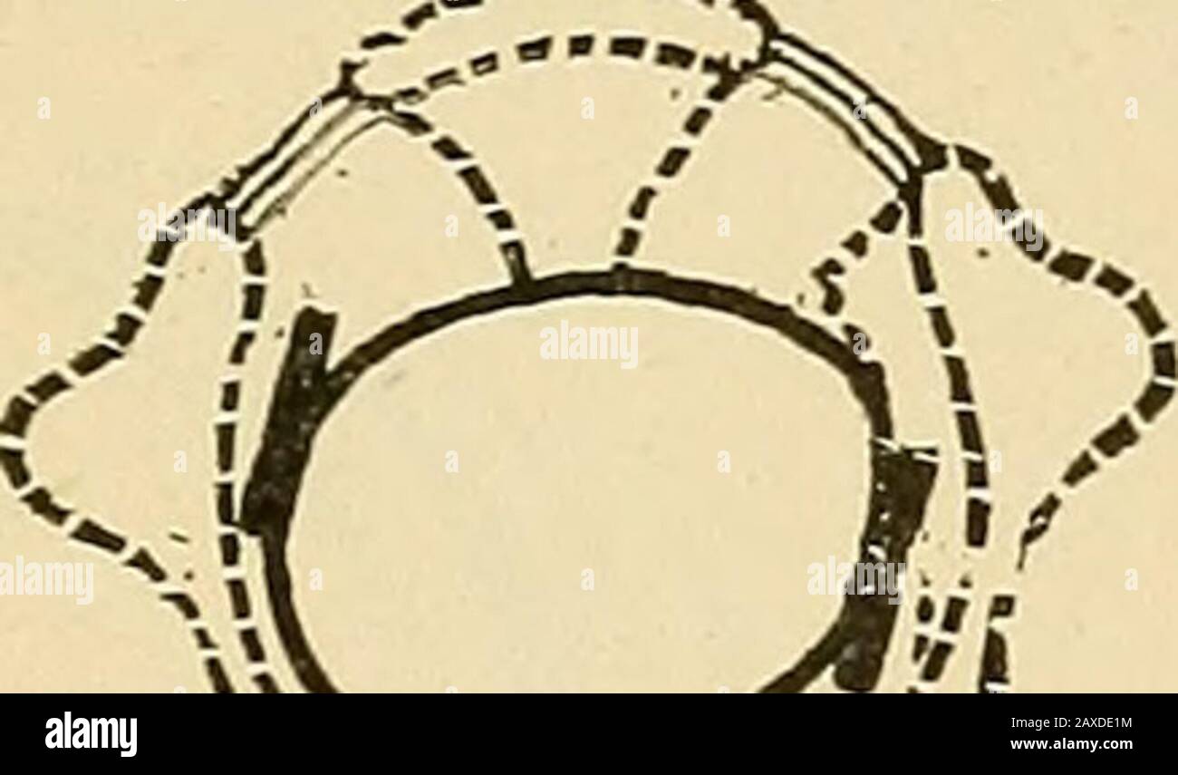 Occiput posterior hi-res stock photography and images - Alamy