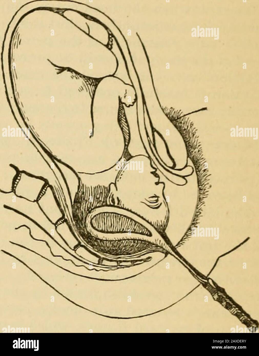 Ver peri hi-res stock photography and images - Alamy