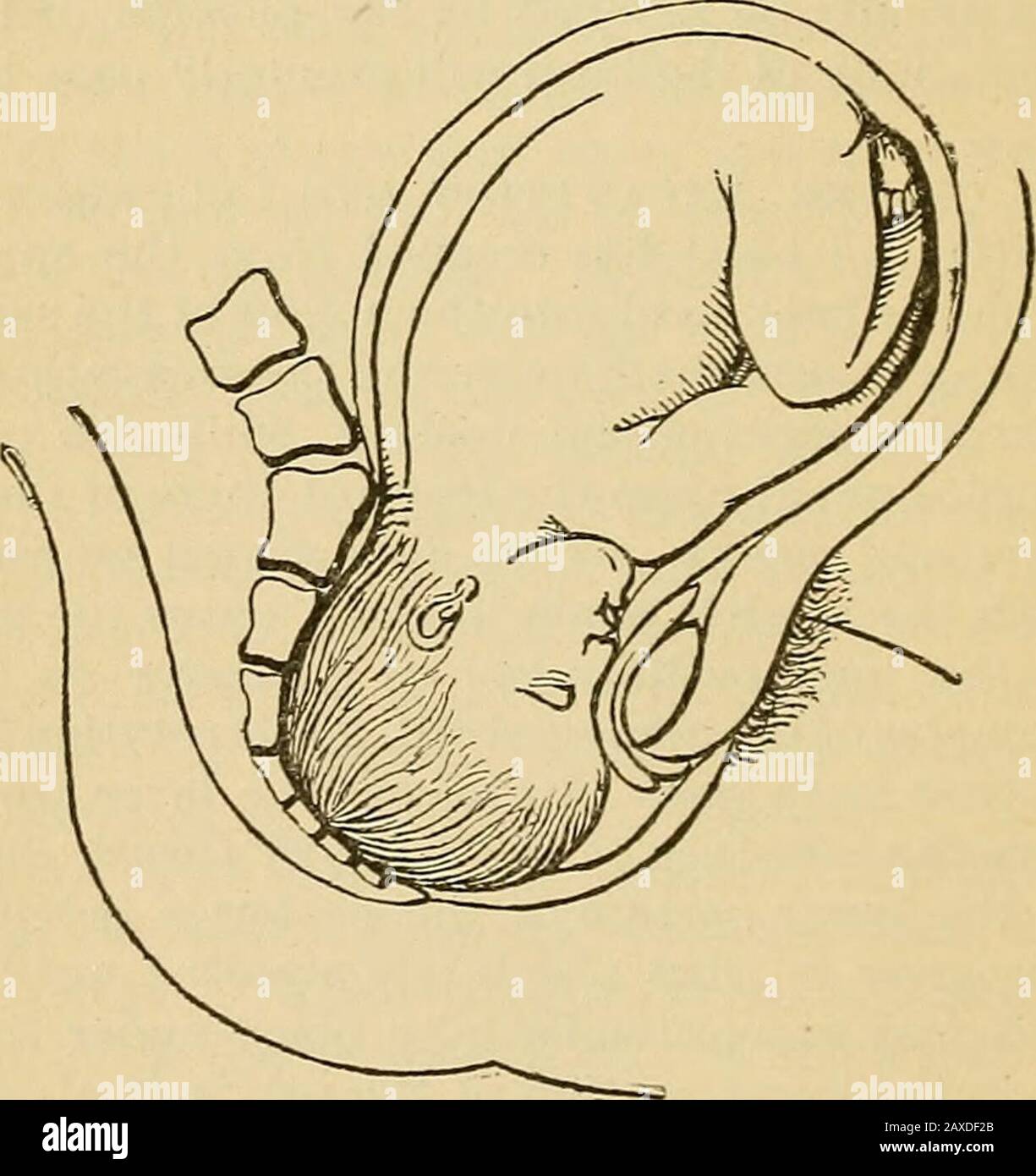 Occiput posterior hi-res stock photography and images - Alamy