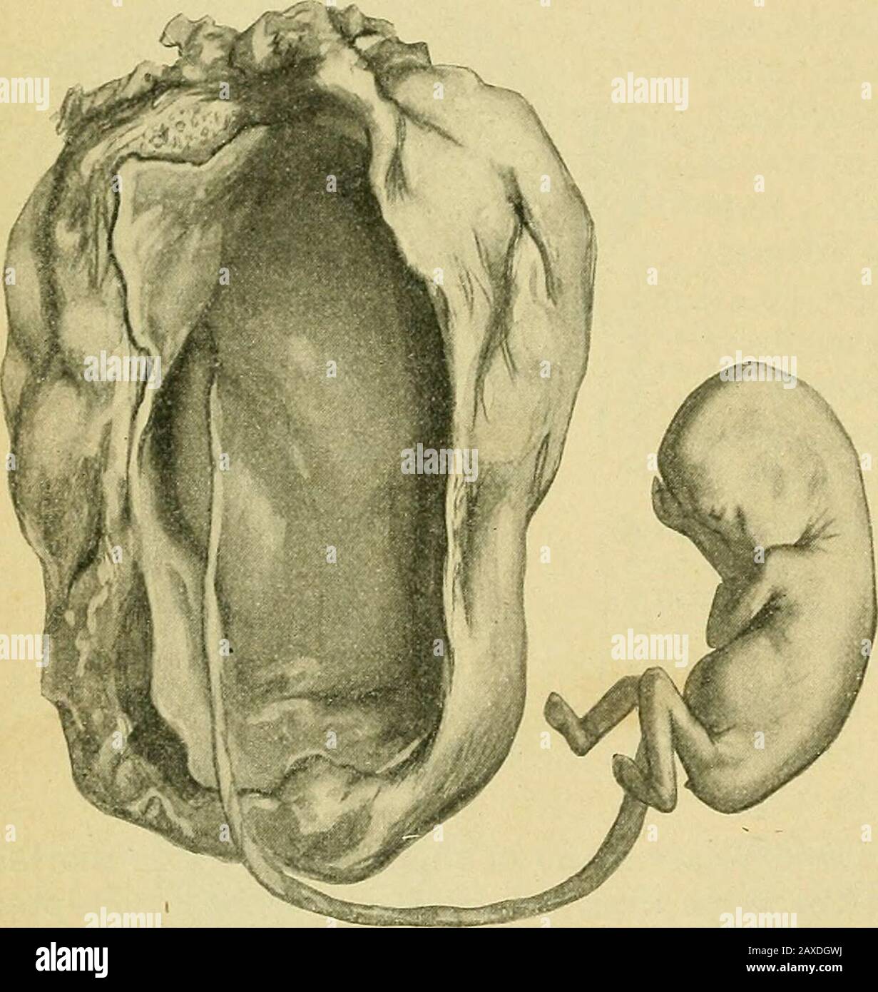 The practice of obstetrics, designed for the use of students and ...