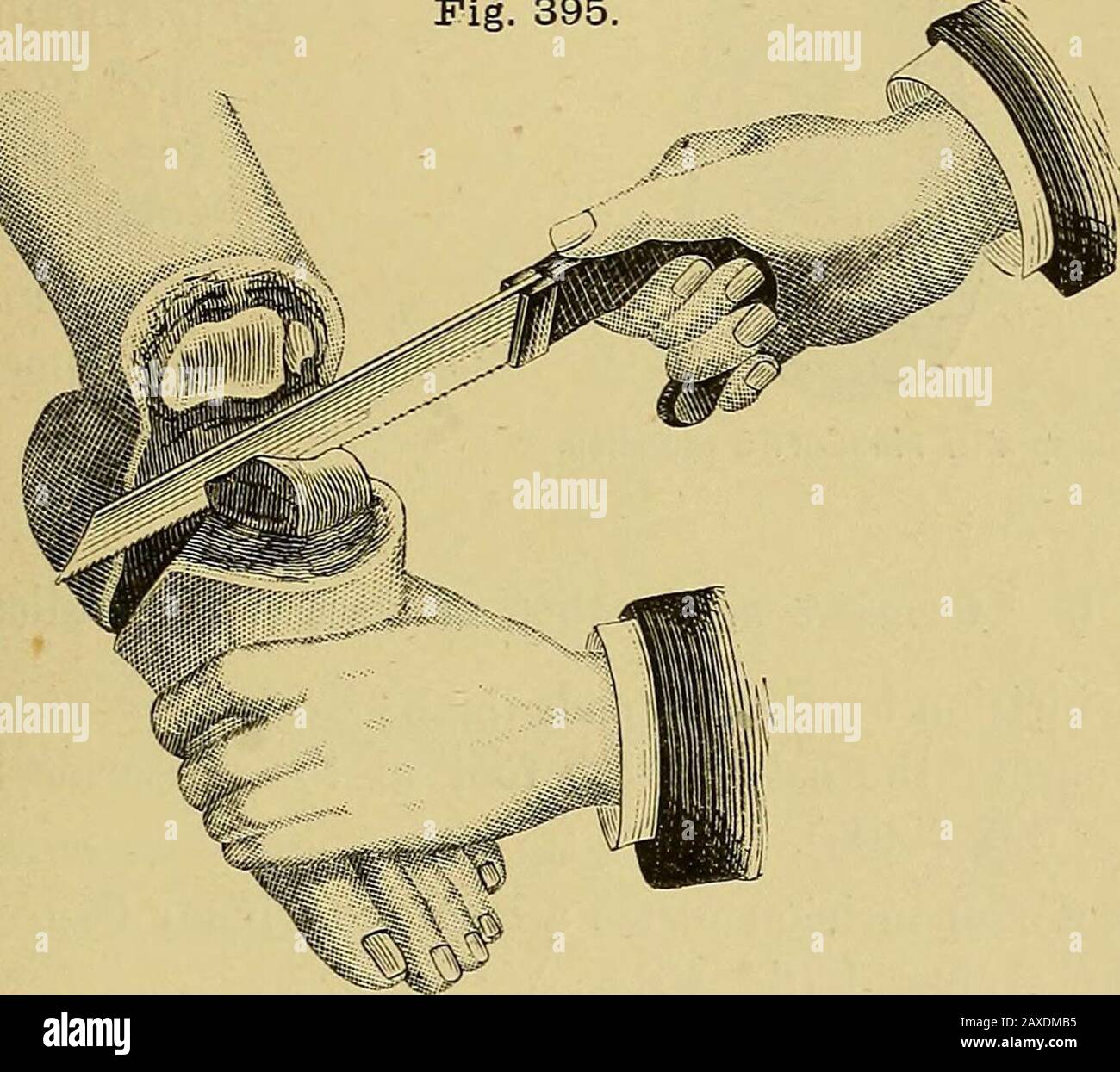 The surgeon's handbook on the treatment of wounded in war : a prize ...