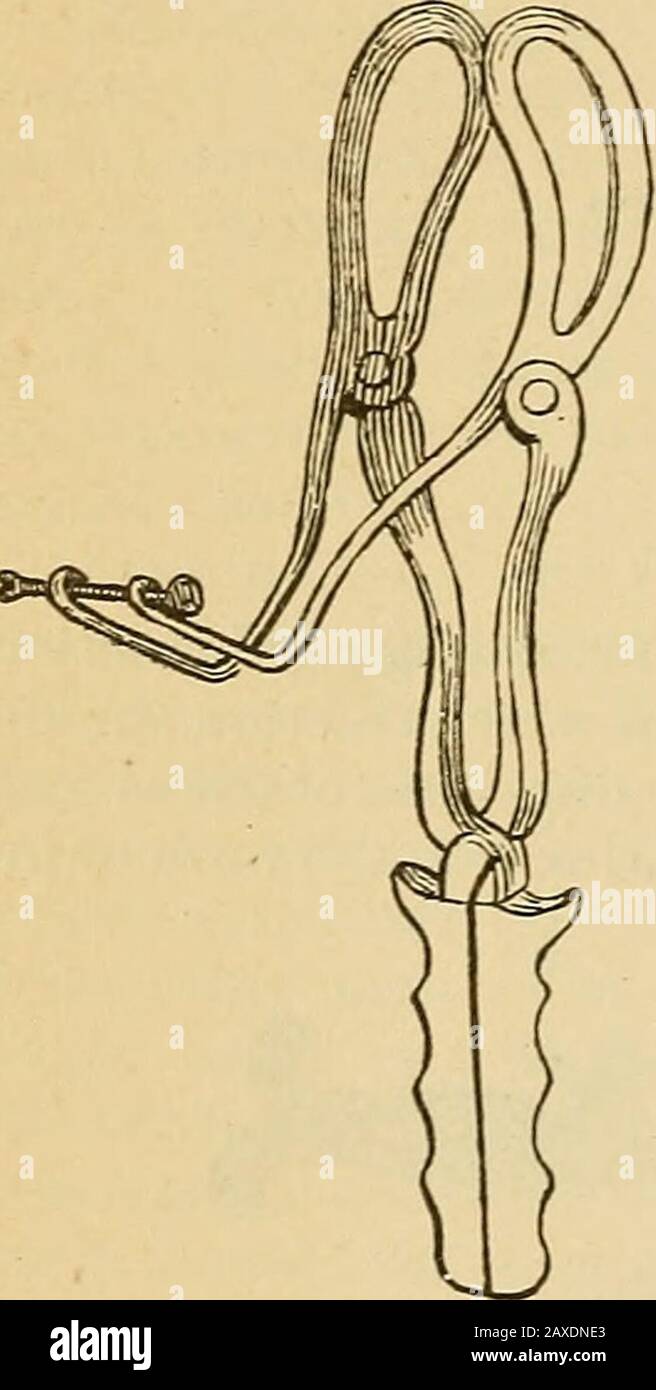 Axis traction forceps hi-res stock photography and images - Alamy