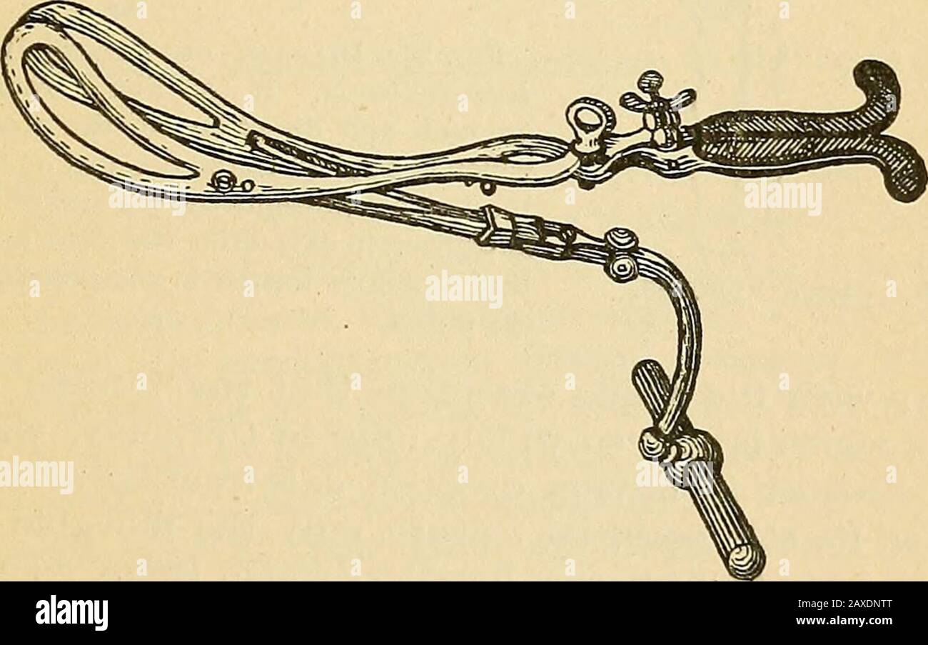Axis traction forceps hi-res stock photography and images - Alamy