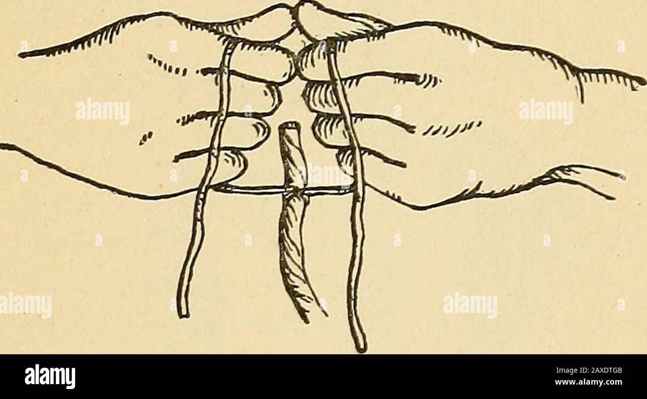 Practical midwifery; handbook of treatment . does not succeed, its ...