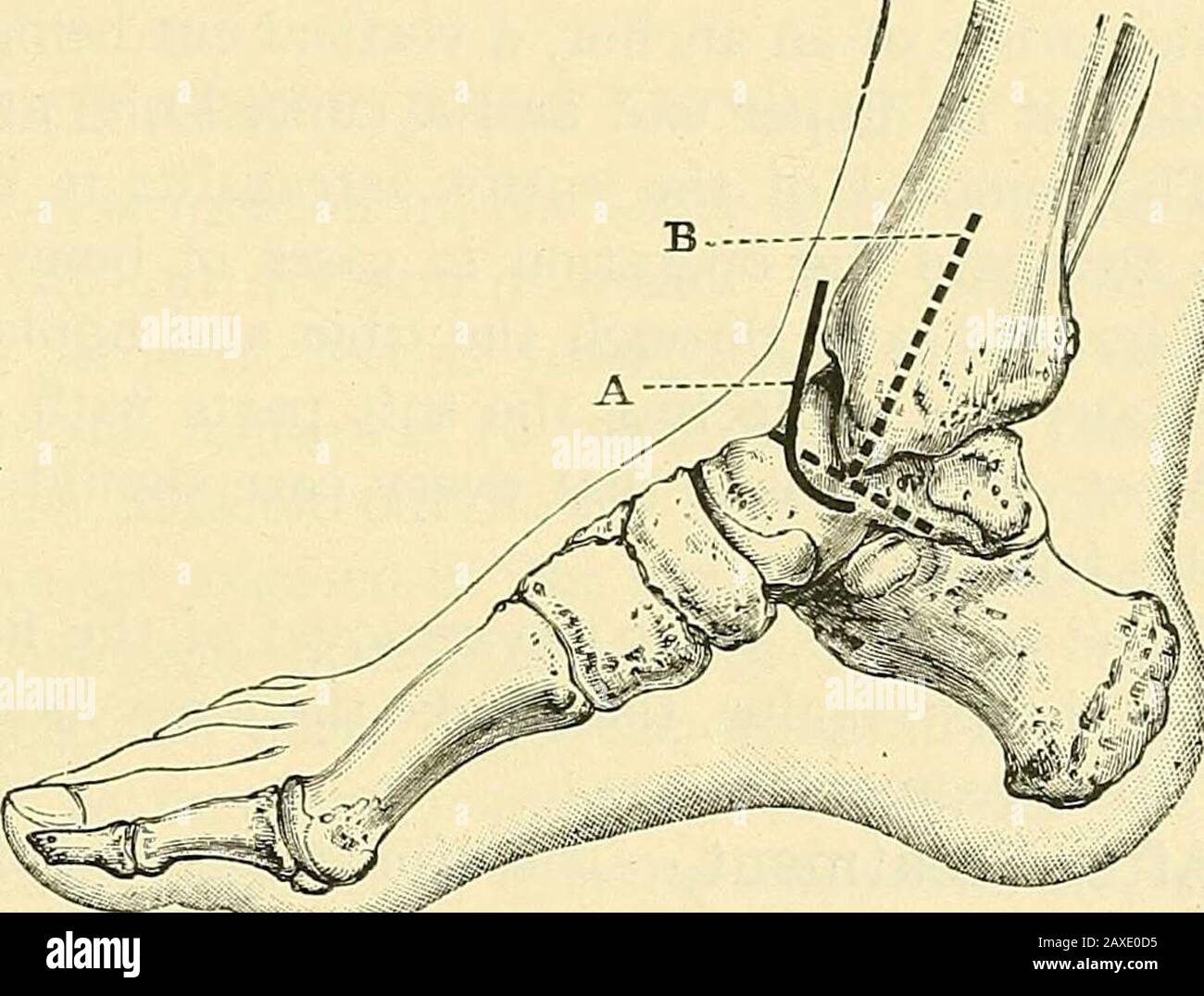 Fibula e tibia hi-res stock photography and images - Alamy