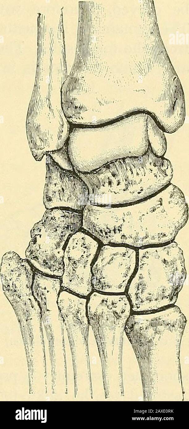 Dorsalis pedis hi-res stock photography and images - Alamy