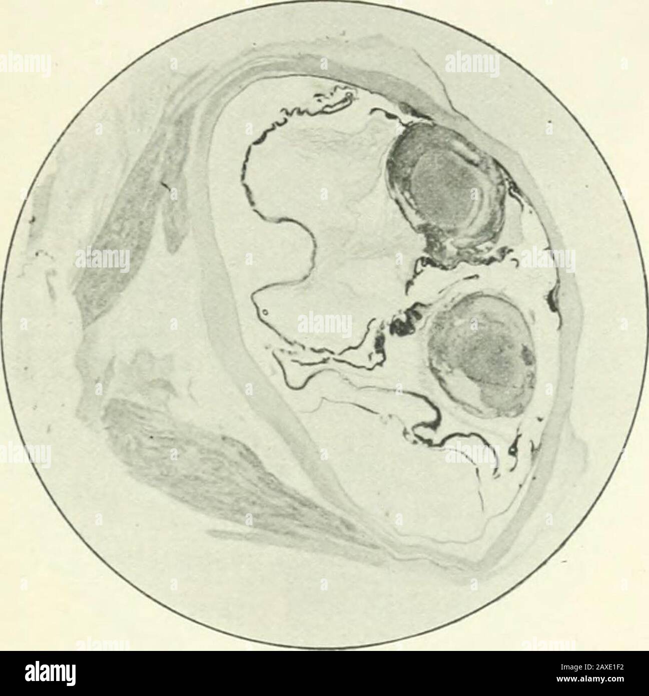 Transactions . n No. 2. Human cyclops showing the base of the skull ...