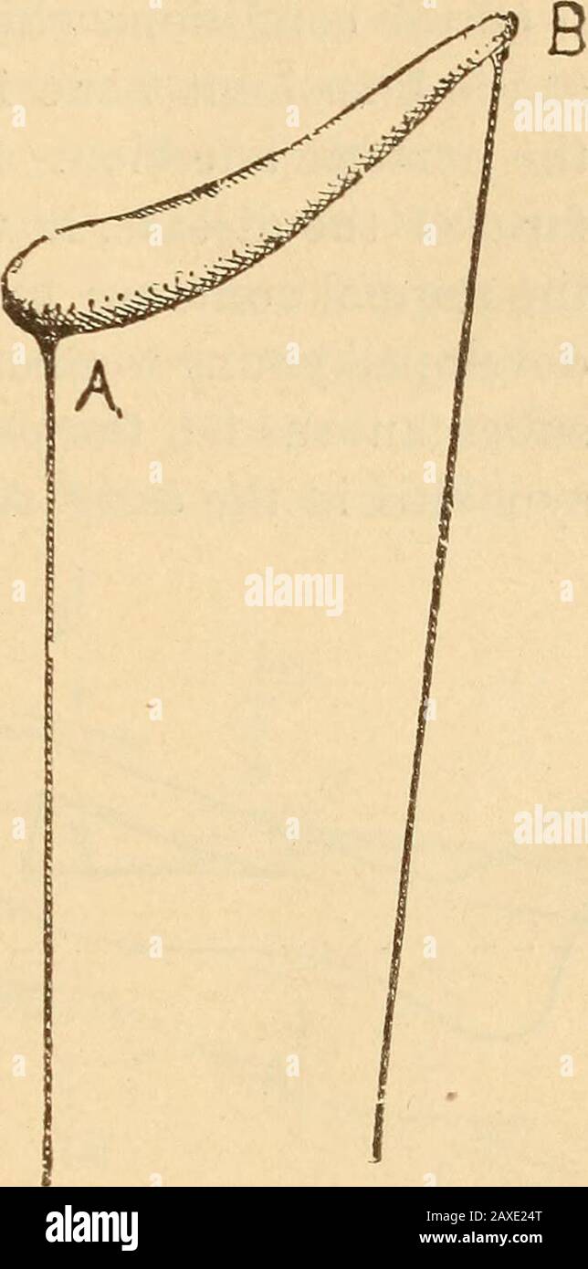 Lectures on orthopedic surgery . Fig. 153.—Showing the front view ofthe ...