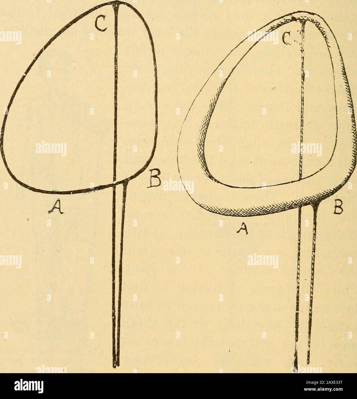 Tibia splint hi-res stock photography and images - Alamy