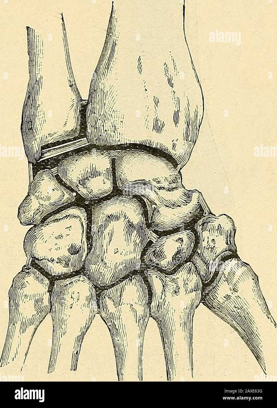 A manual of operative surgery . d horizontallyjust below the tip of the ...