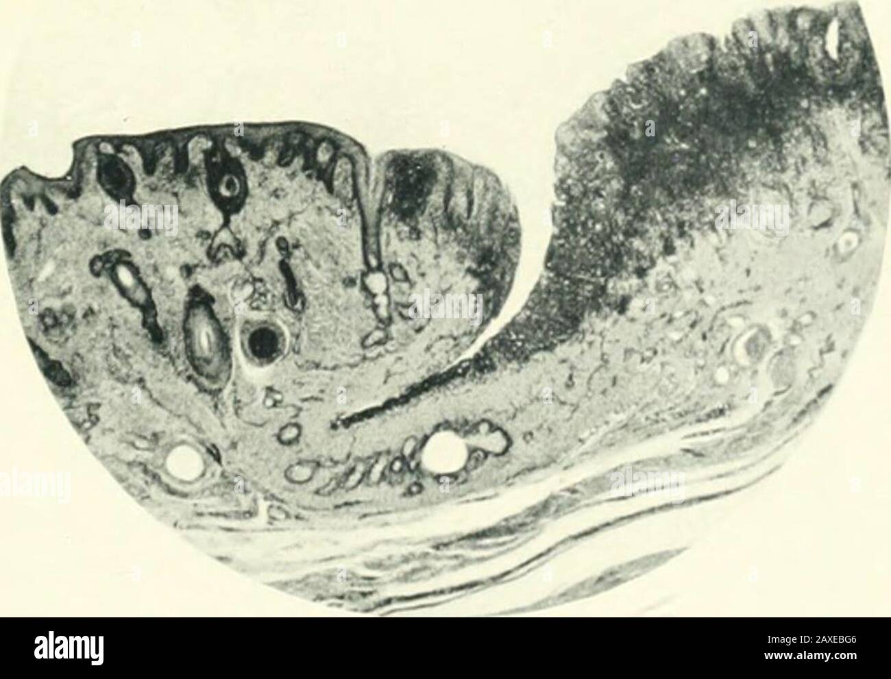 Conjunctival sac hi-res stock photography and images - Alamy