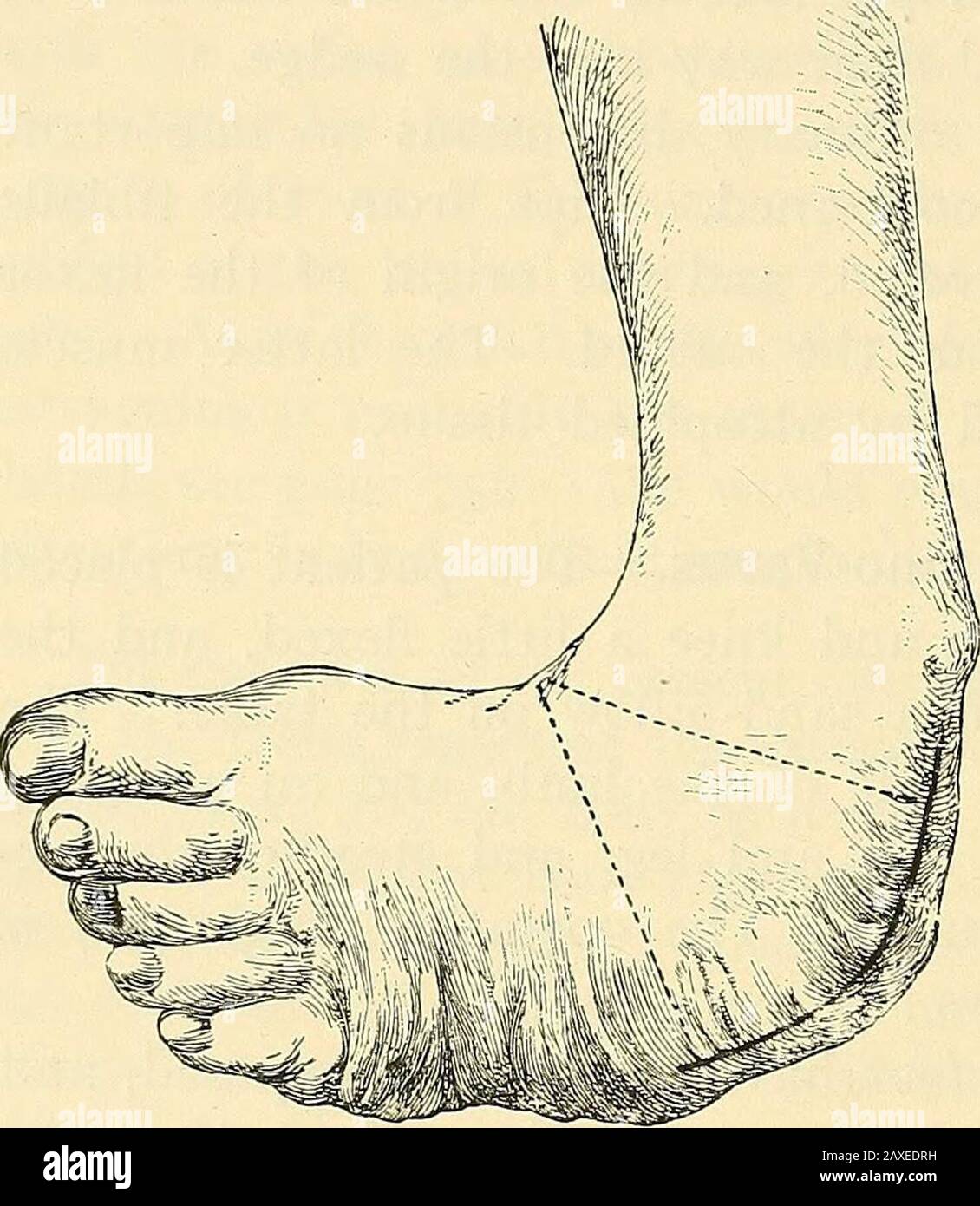 A manual of operative surgery . atulas arenow introduced betweenthe ...