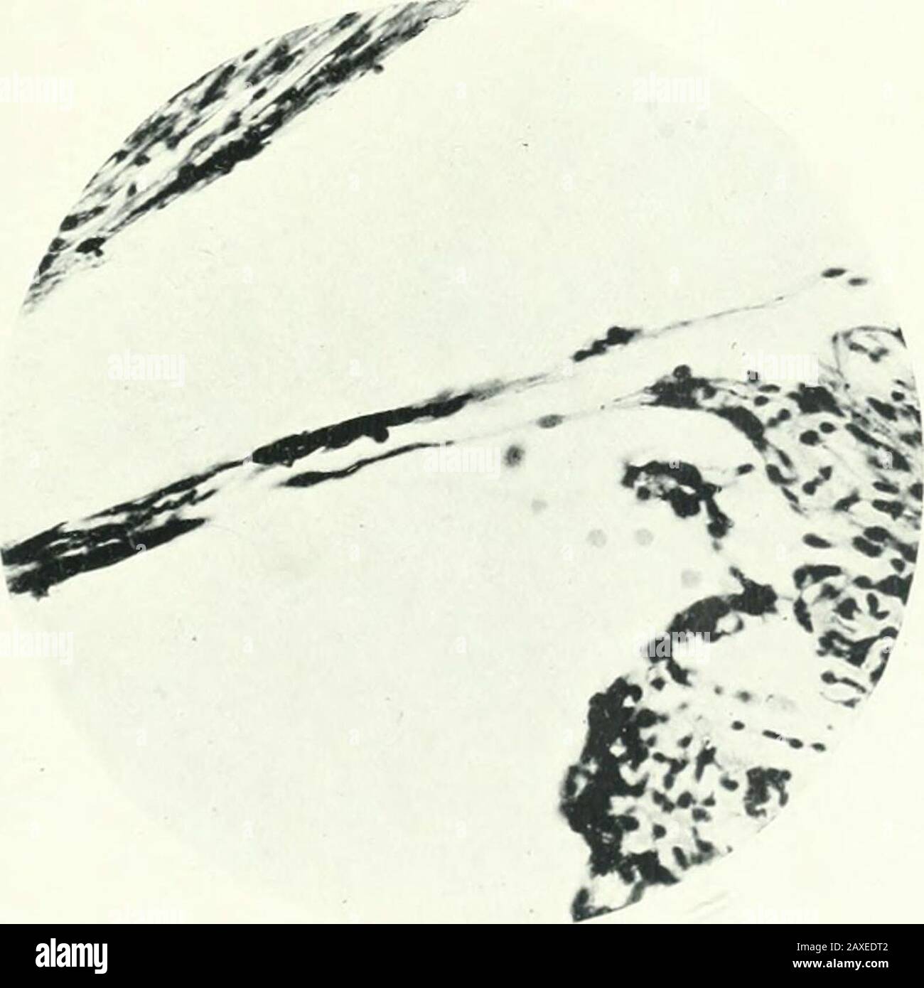 Caseation High Resolution Stock Photography and Images - Alamy