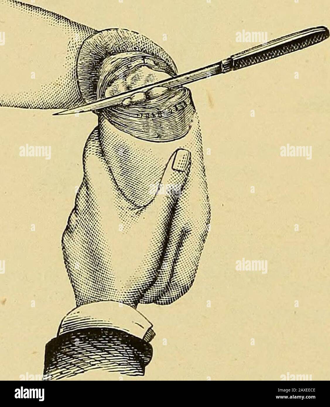 The surgeon's handbook on the treatment of wounded in war : a prize ...