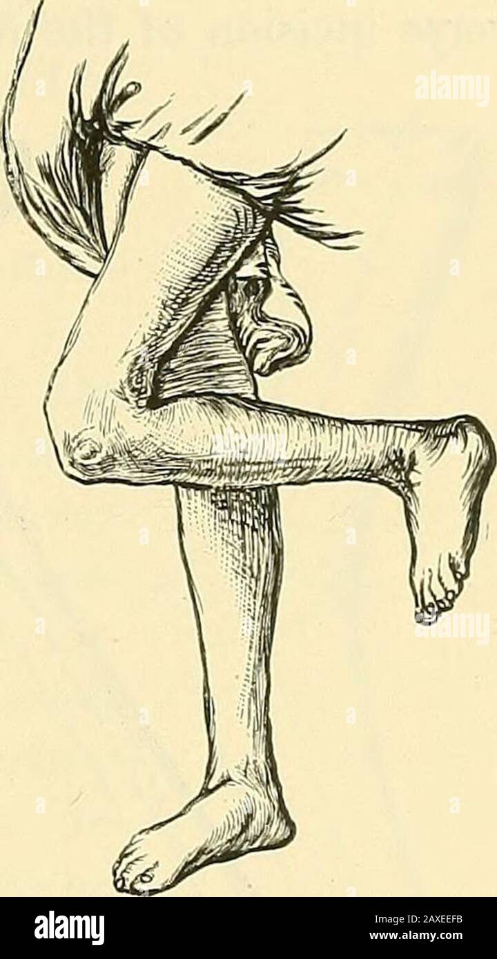 Difficultproblem hi-res stock photography and images - Alamy