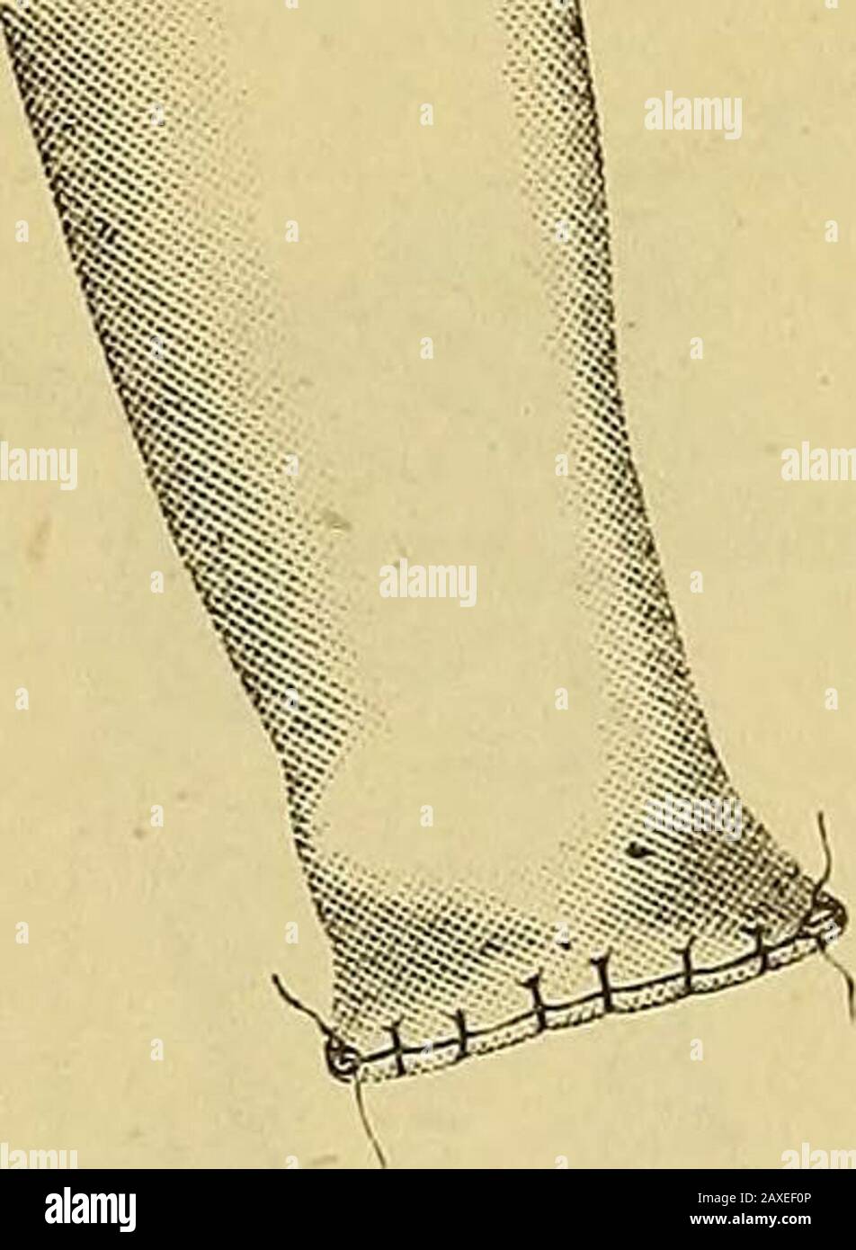 Styloid Process High Resolution Stock Photography and Images - Alamy