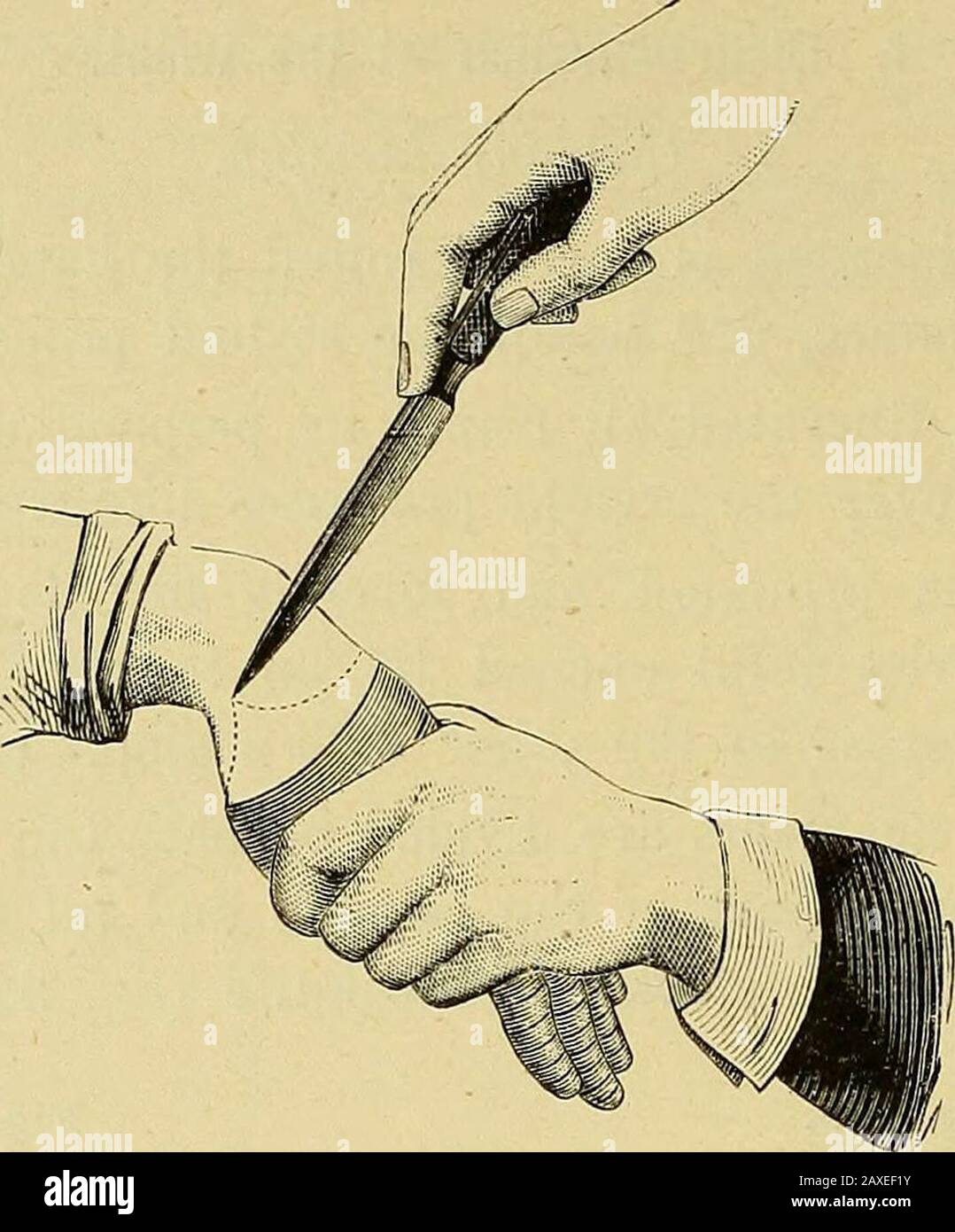 Styloid process hi-res stock photography and images - Alamy