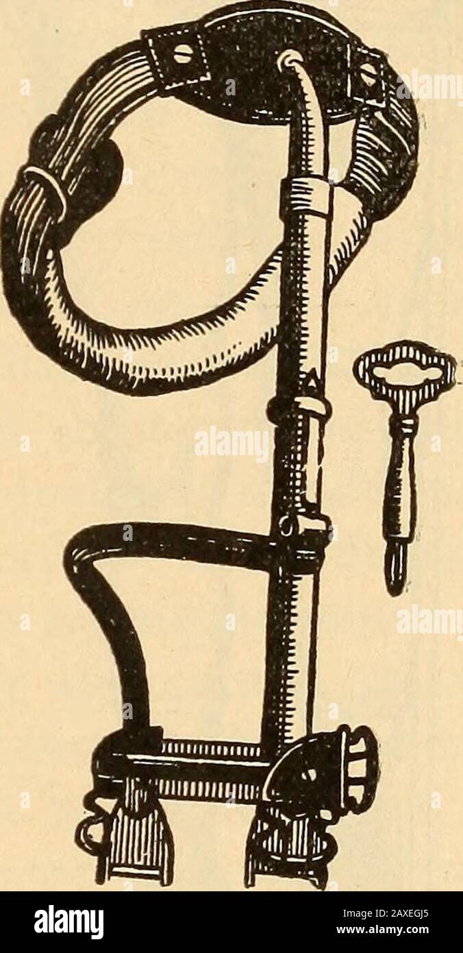 Lectures on orthopedic surgery . Fig, 104.—The Henry G. Davis hip ...