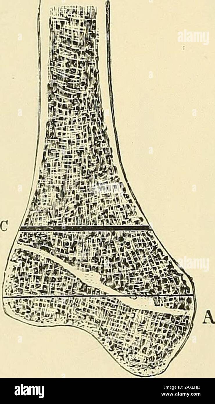 A manual of operative surgery . in the epiphysis (Fig. 434). The ...