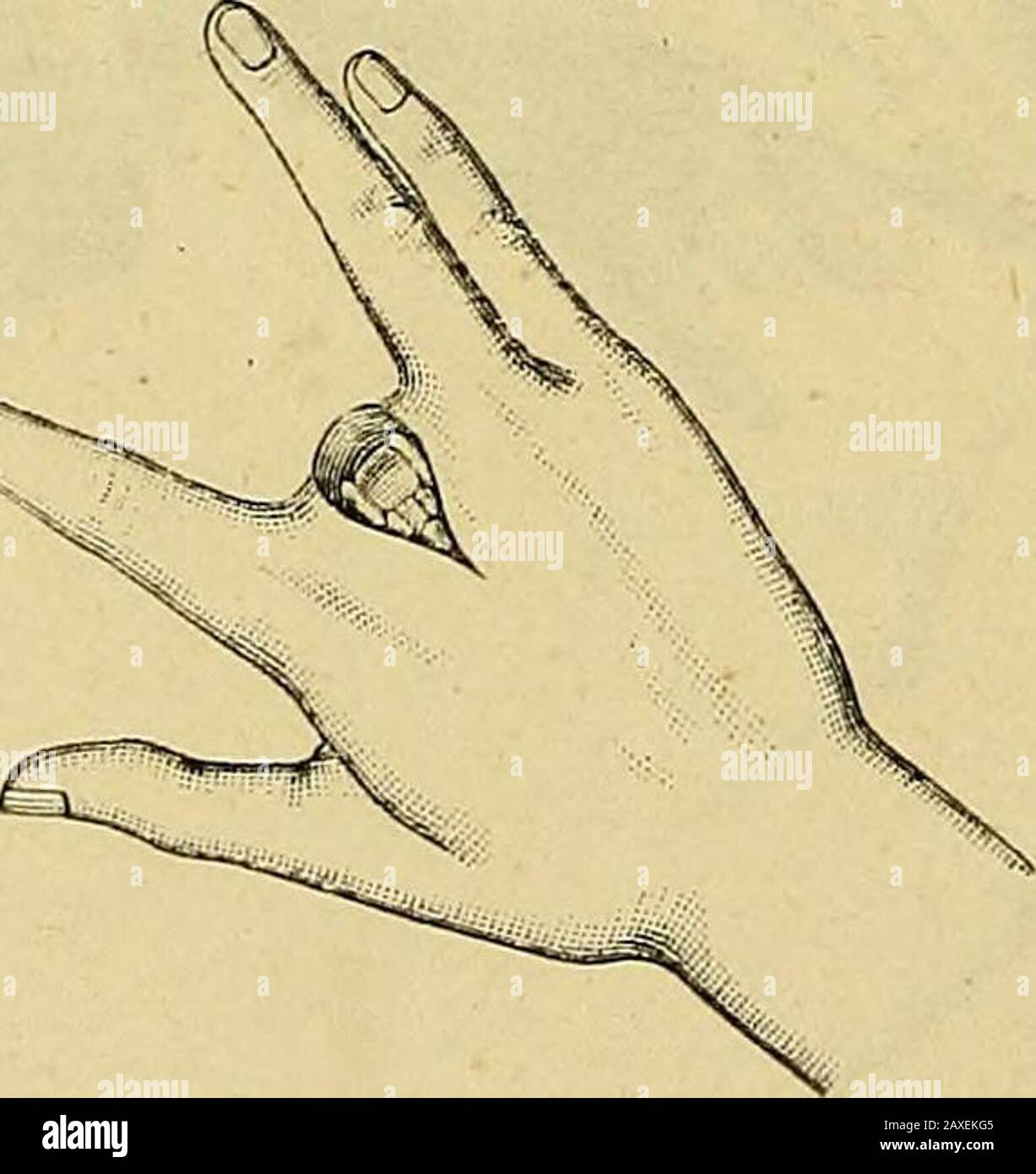 The surgeon's handbook on the treatment of wounded in war : a prize ...